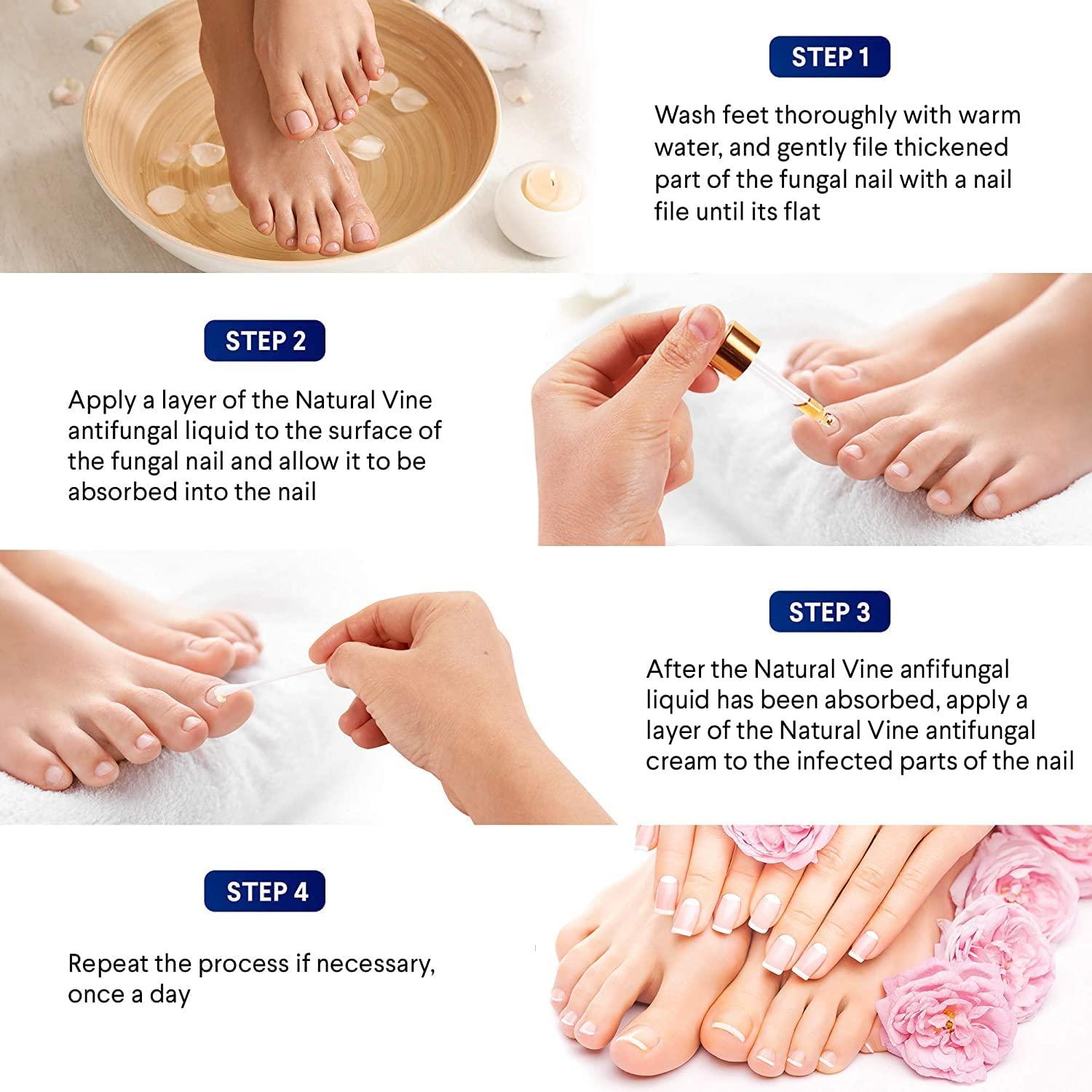 Extra Strength Toenail Fungus Treatment Kit - 15ML Liquid & 20G Nail ...