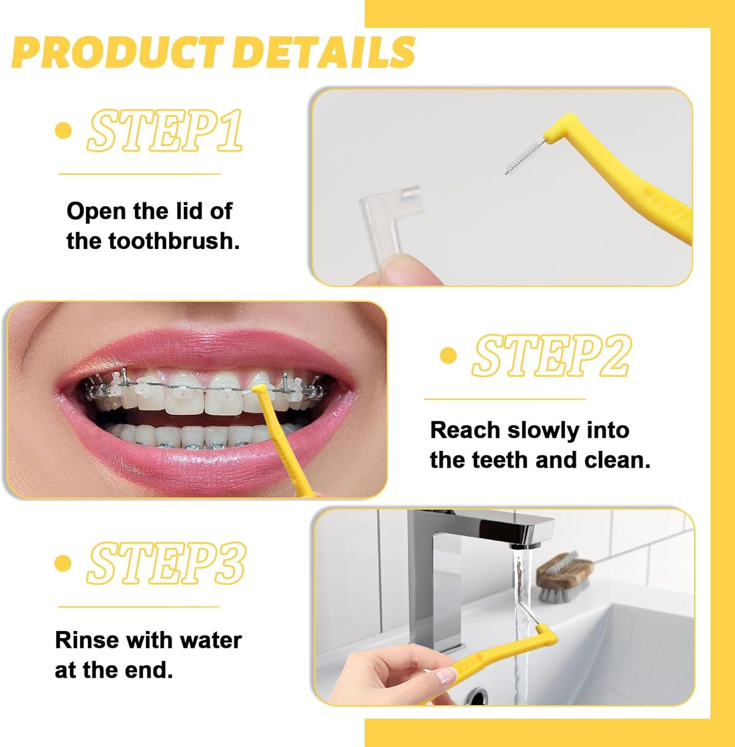 Modixun Interdental Brushes & Dental Floss for Braces | 40-Piece ...