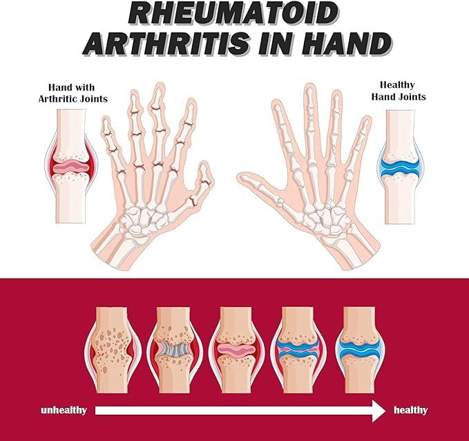 FOXZY Joint Bone Cream - Intensive Therapy for Joints and Muscles 2pc