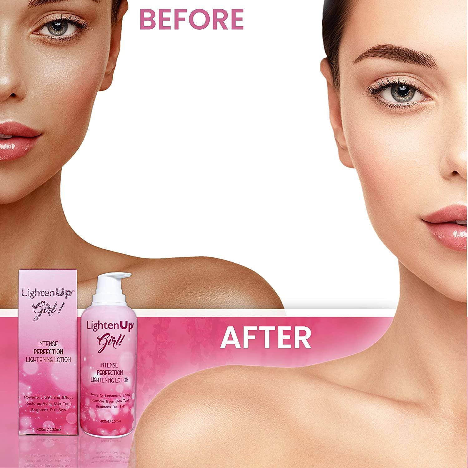 LightenUp Girl! Skin Lightening Lotion | 13.5 fl oz | Uneven Skin Tone ...