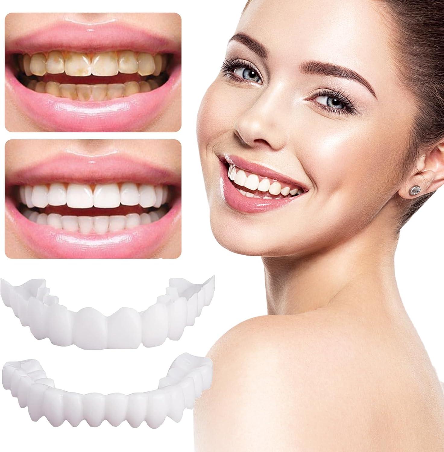 Instant Snap-On Teeth Veneers | Upper & Lower Pairs for Perfect Smile ...
