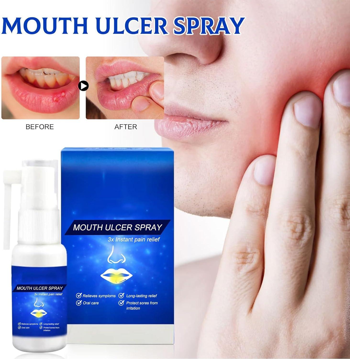 Herbal Ulcer & Canker Relief Oral Care Spray for Dry Mouth - Fast ...