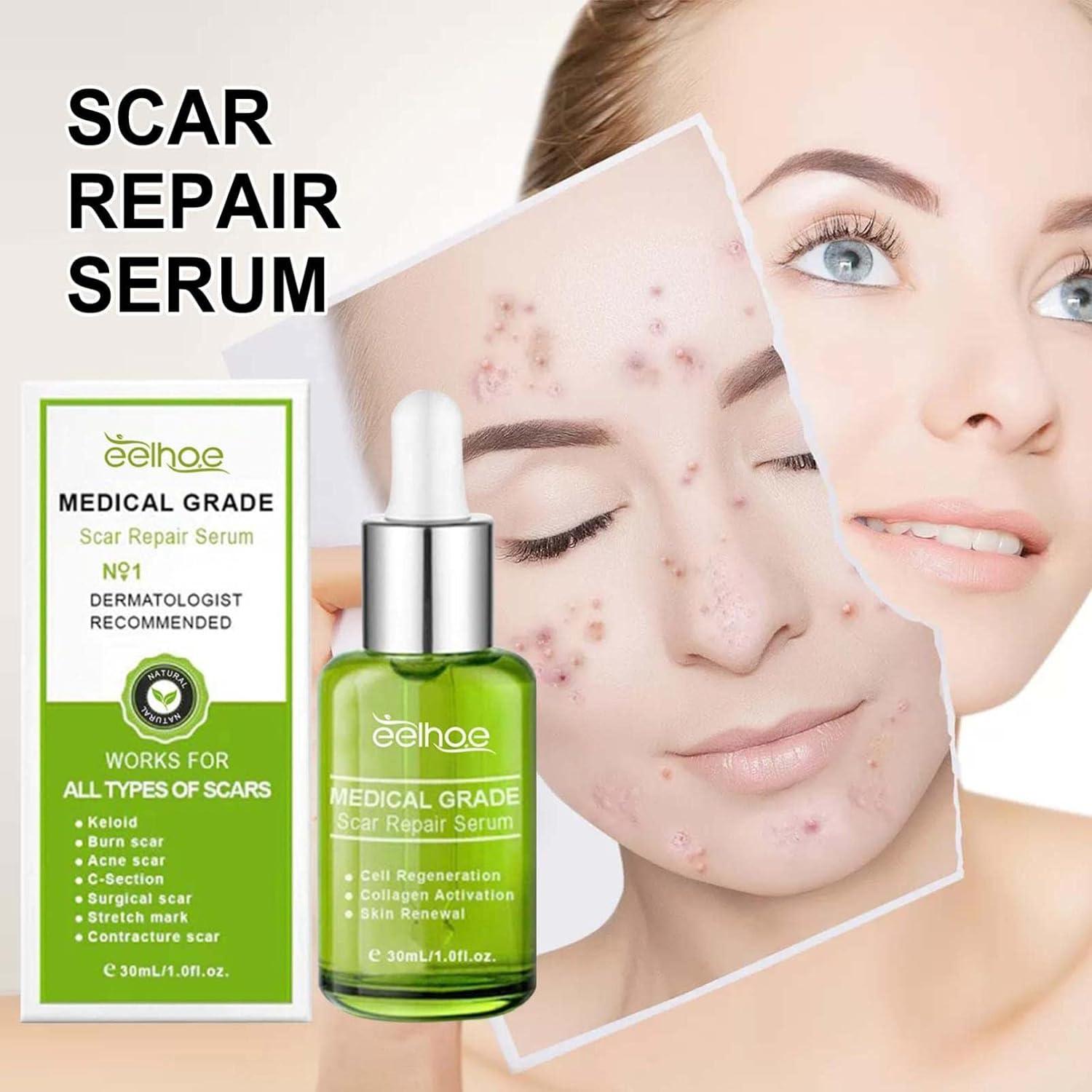 Advanced Scar Repair Serum - Medical Grade Spray for Acne, Surgical ...