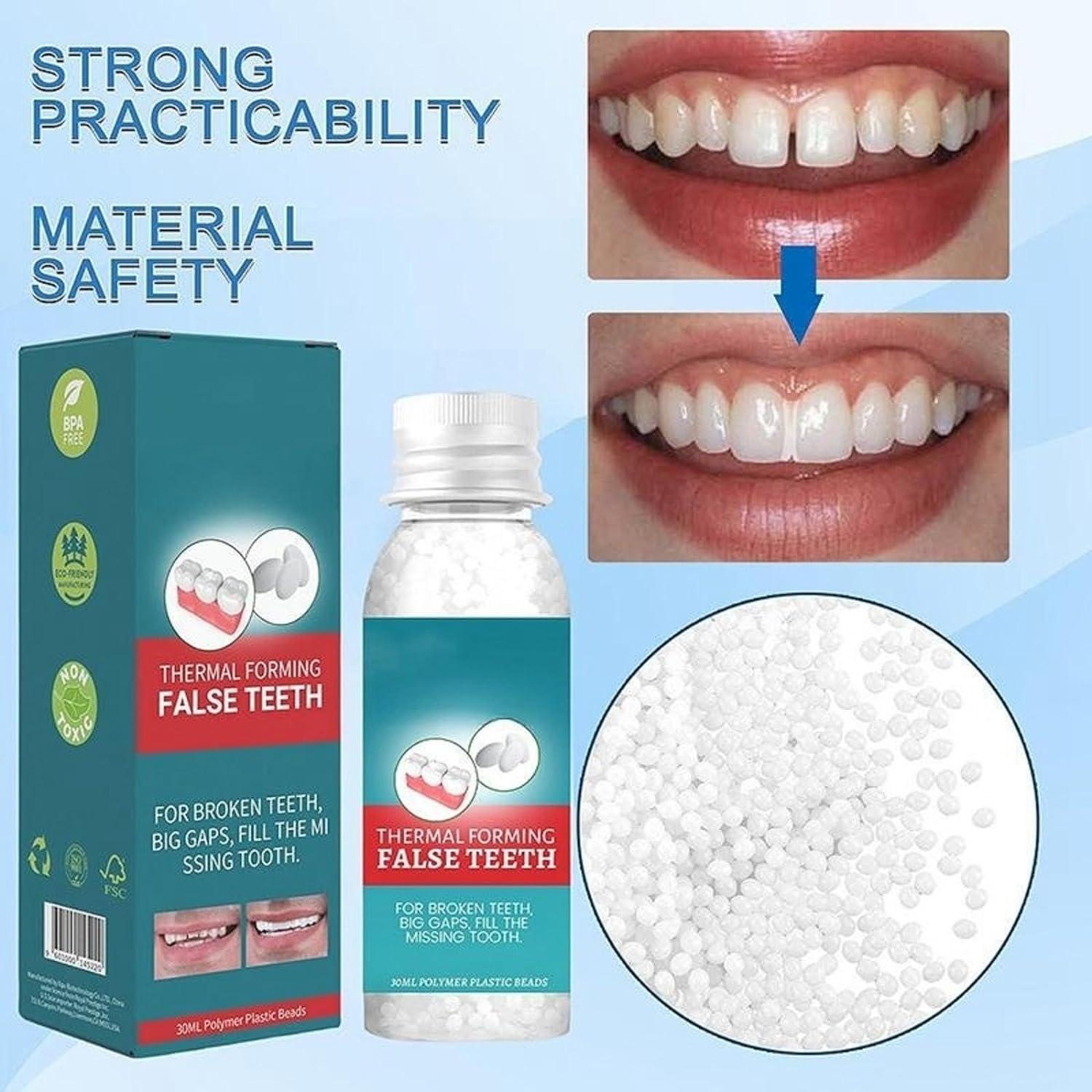 DIY Temporary Tooth Filling Repair Kit - Dental Tooth Filler for Broken ...
