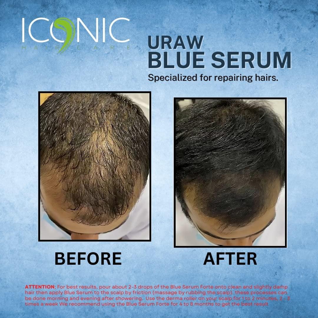 URAW Blue Serum 100ml - Effective Hair Growth & Anti-Hair Loss Serum ...
