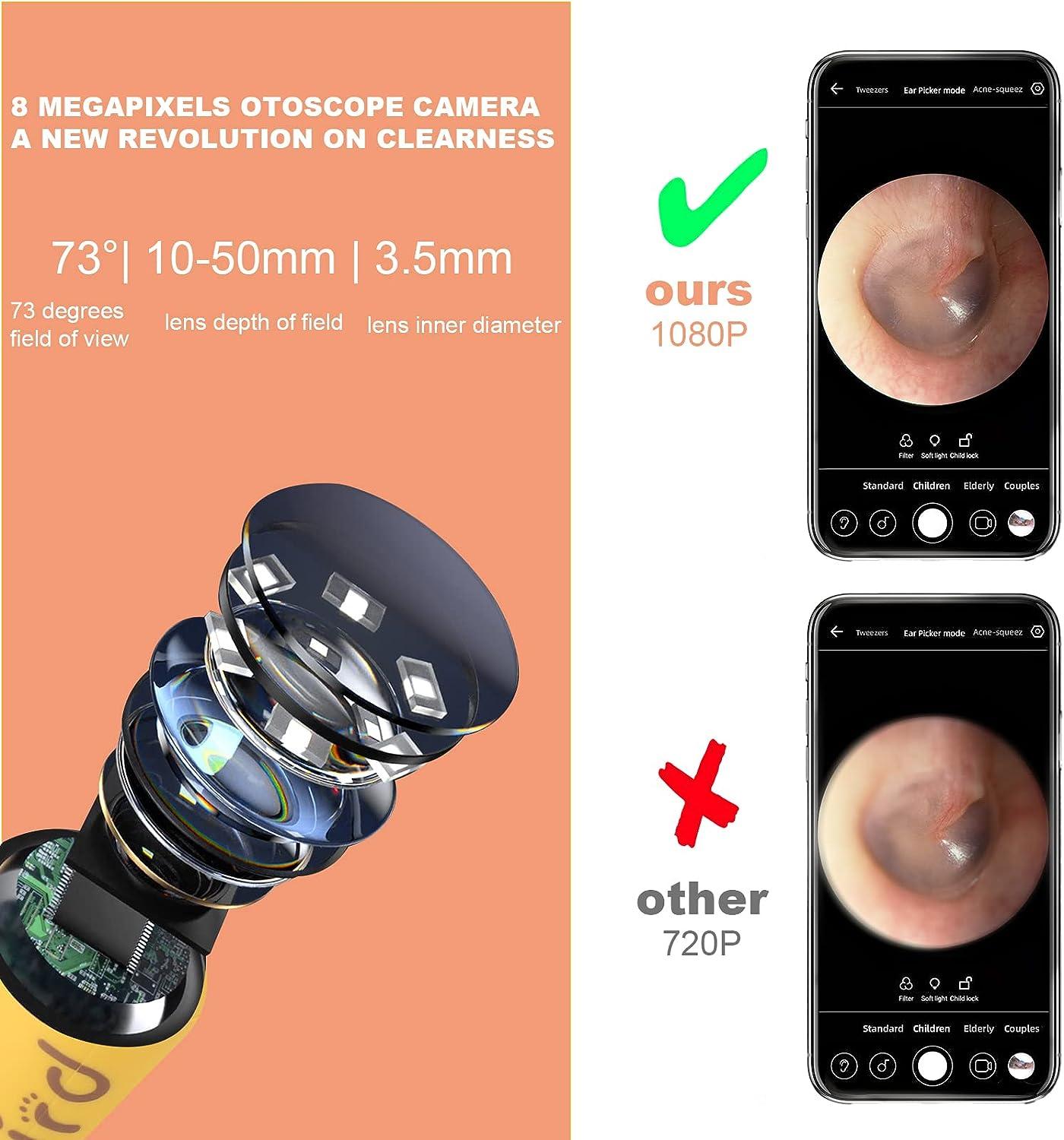 BEBIRD D3 Pro Smart Ear Wax Removal Otoscope Giraffe-Shaped 1080p FHD ...