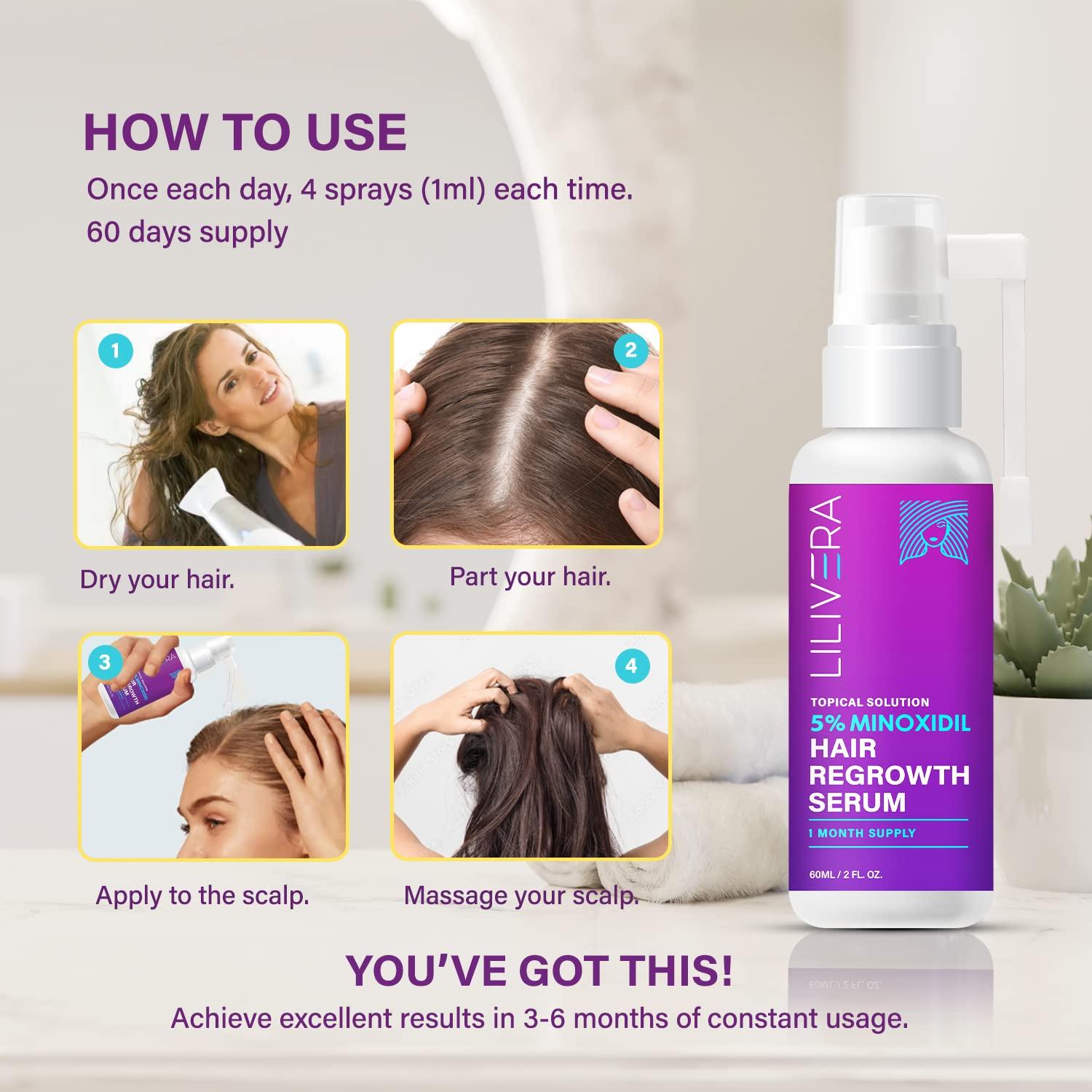 5% Minoxidil Hair Growth Spray for Women and Men - Regrowth Treatment ...