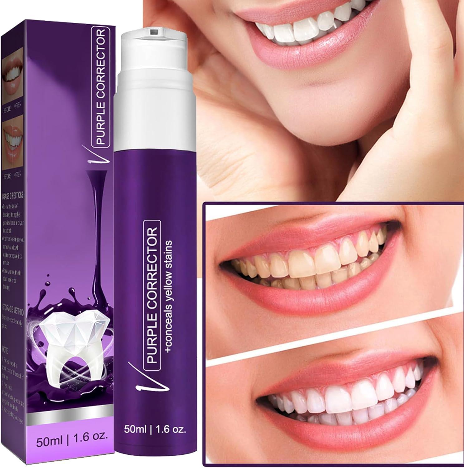 V34 Purple Toothpaste - Teeth Whitening Solution | 50ml Stain Removal ...