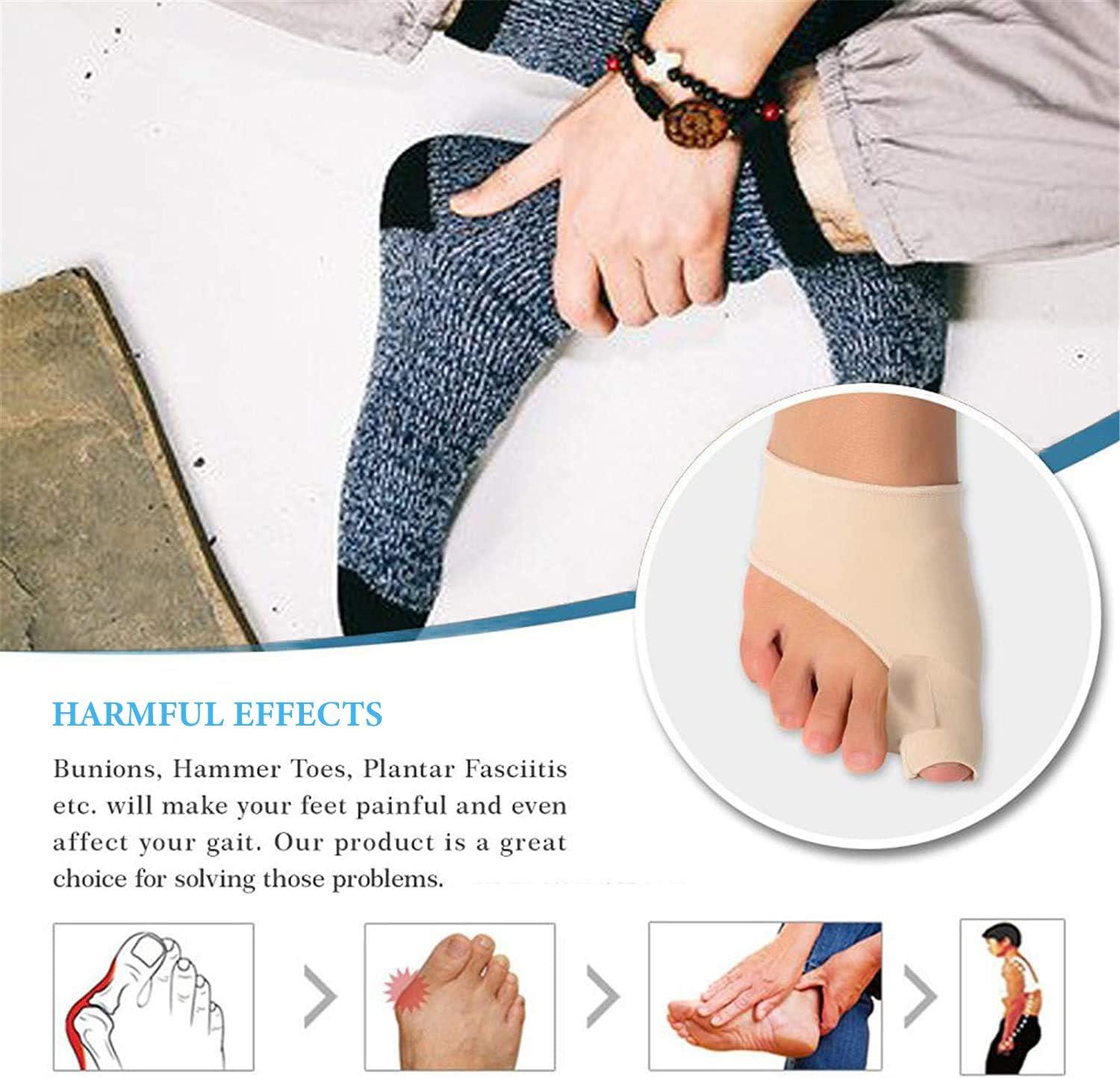 Non-Surgical Bunion Corrector | Hallux Valgus Alignment & Toe Spacer ...