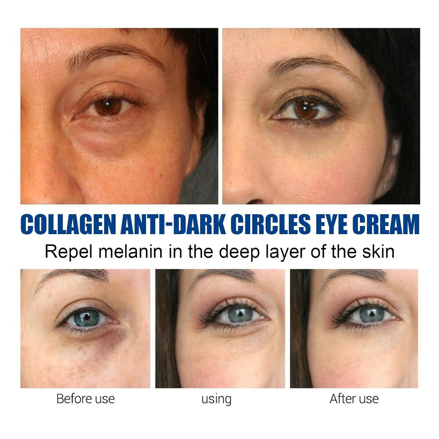 Jasmine Ointment Plus: Anti-Wrinkle Eye Cream for Dark Circles ...