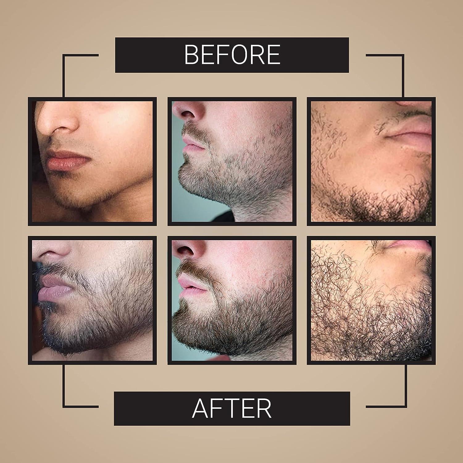 Beard Growth Biotin Supplement with Collagen | 60 Beard Vitamins for ...