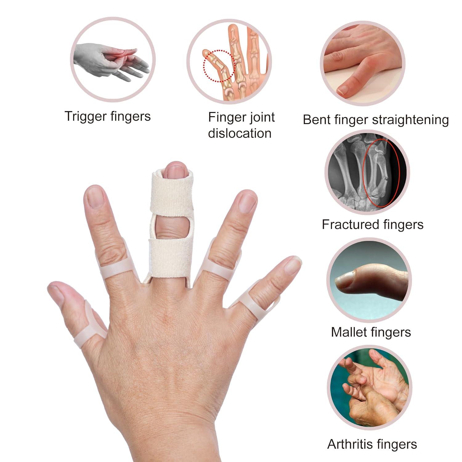 Buy Oval Finger Splint | Effective Relief for Trigger Finger Arthritis ...