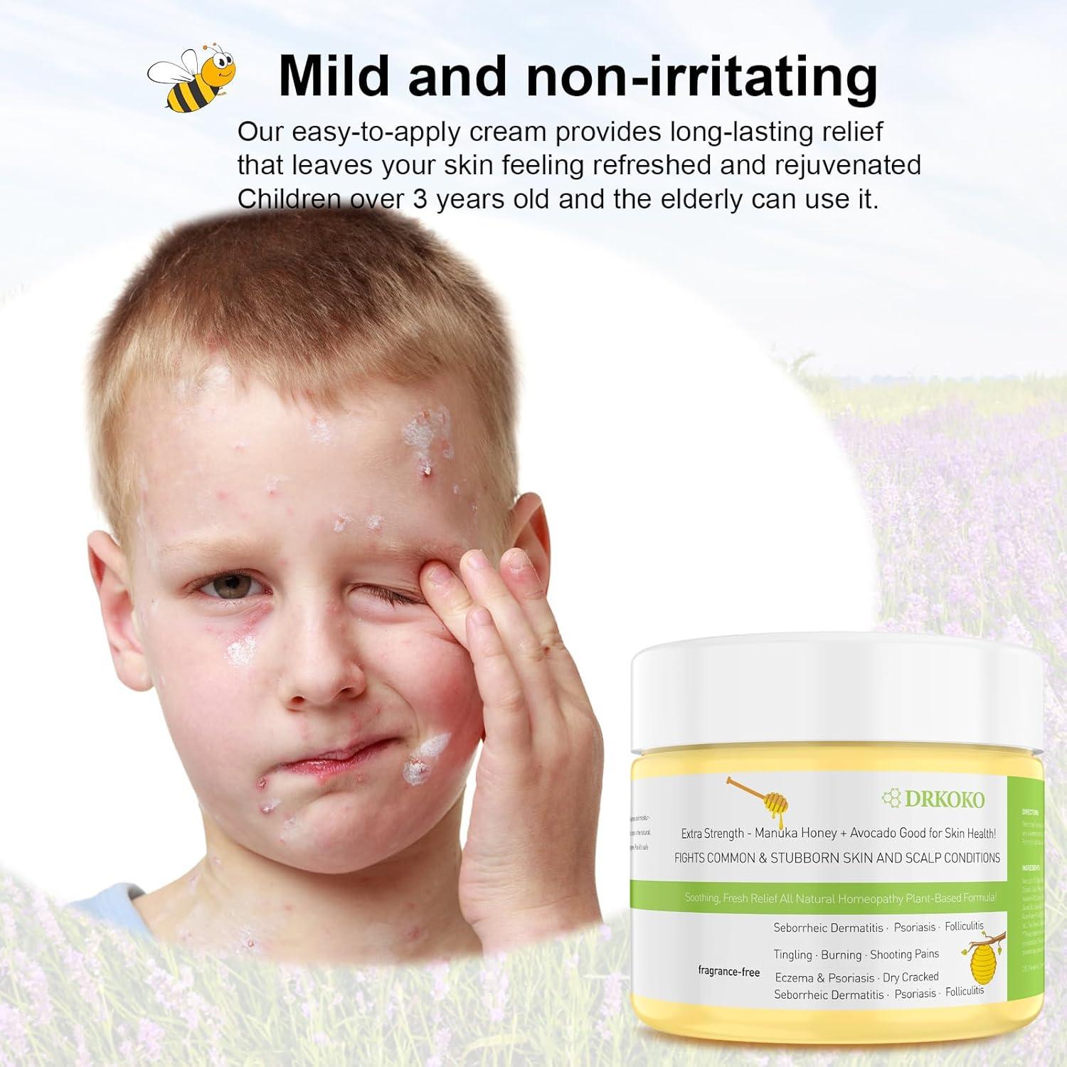 Buy 1 Pack Manuka Honey Eczema Cream with Tea Tree Oil | Soothing ...