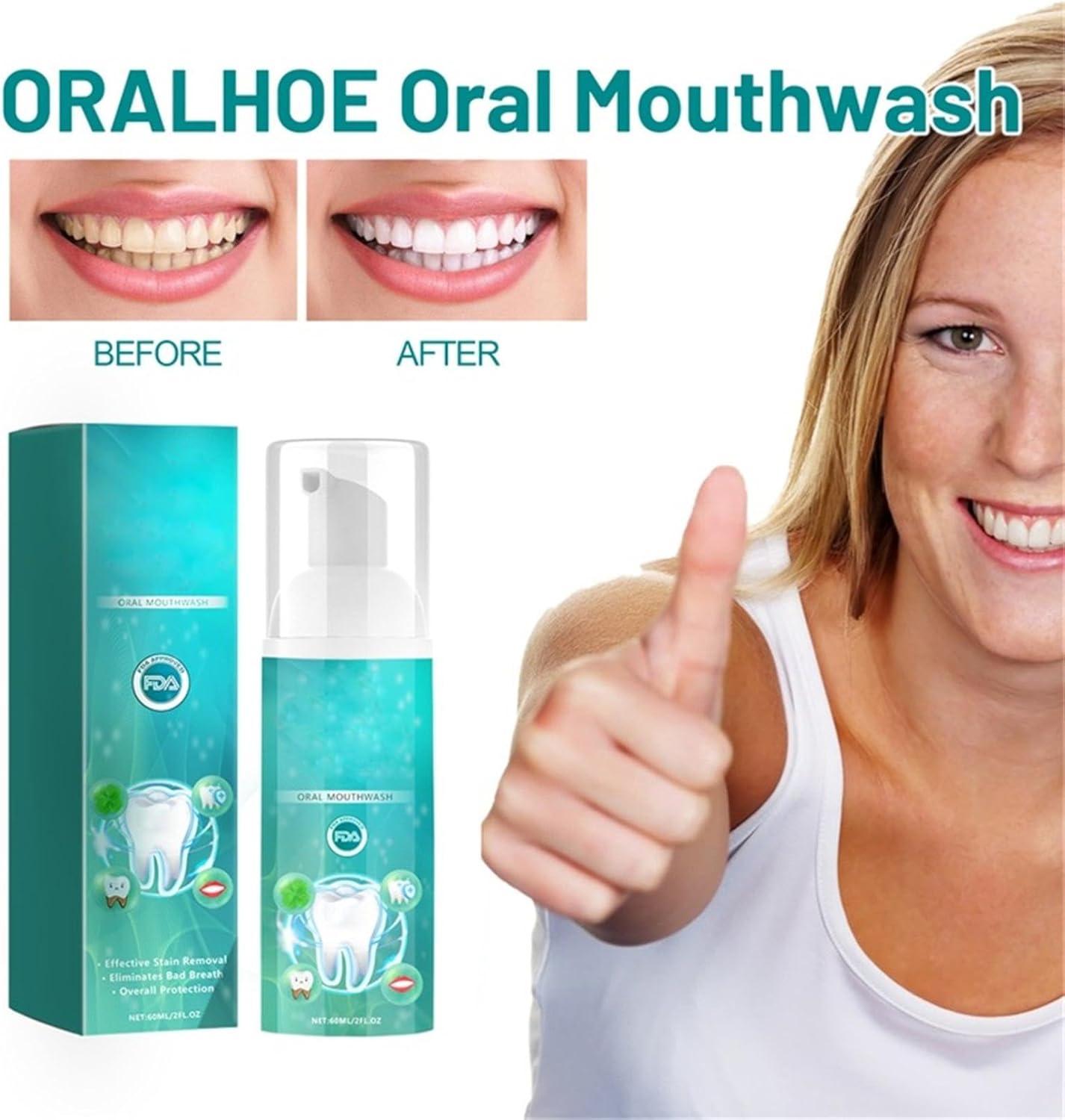 Furzero Smartsmile Mouthwash - 60ml Total Care Oral Rinse for Healthy ...