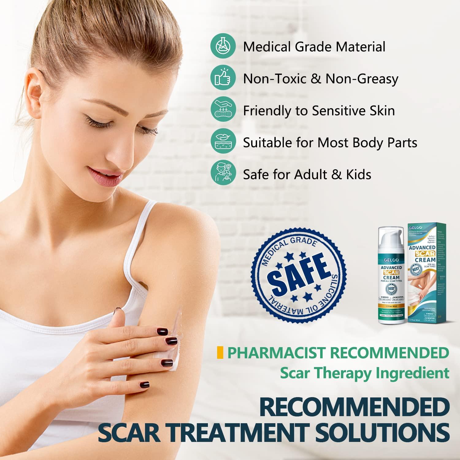 Geloo Advanced Scar Cream Gel 50g - Silicone Gel for Scar Treatment ...