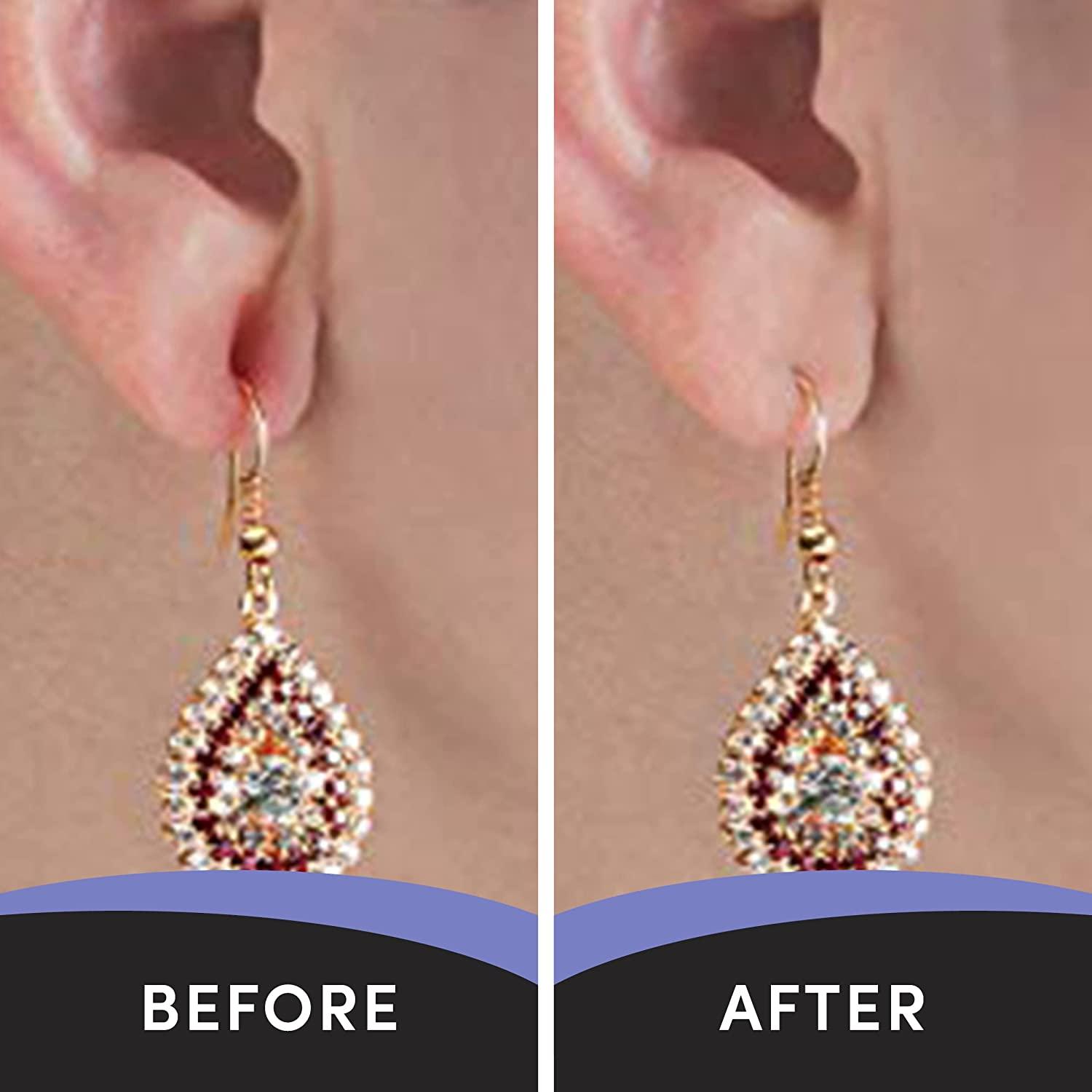 Lobe Miracle Clear Earring Support Patches - Ear Care for Droopy, Torn ... Lobe Miracle Clear Earring Support Patches - Ear Care for Droopy, Torn ...