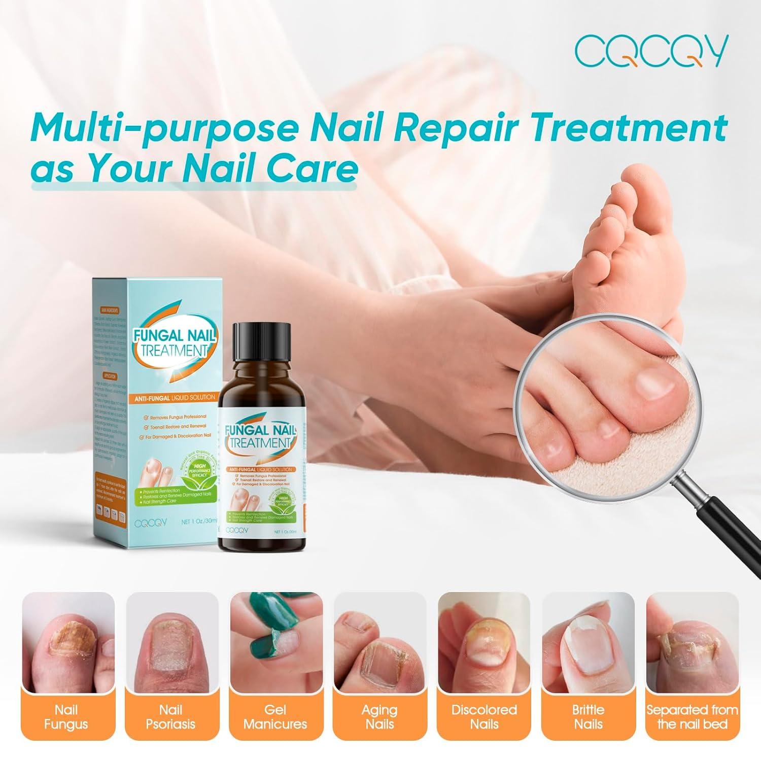 2025 Nail Repair Solution for Toenail Fungus | Extra Strength Fungal ...