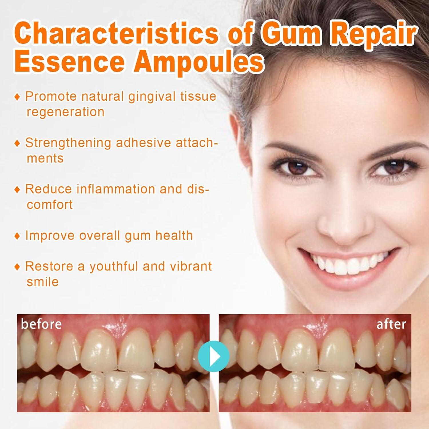 Toothpaste Toothing Meat Repair Essence Ampoules - Advanced Gum Care ...
