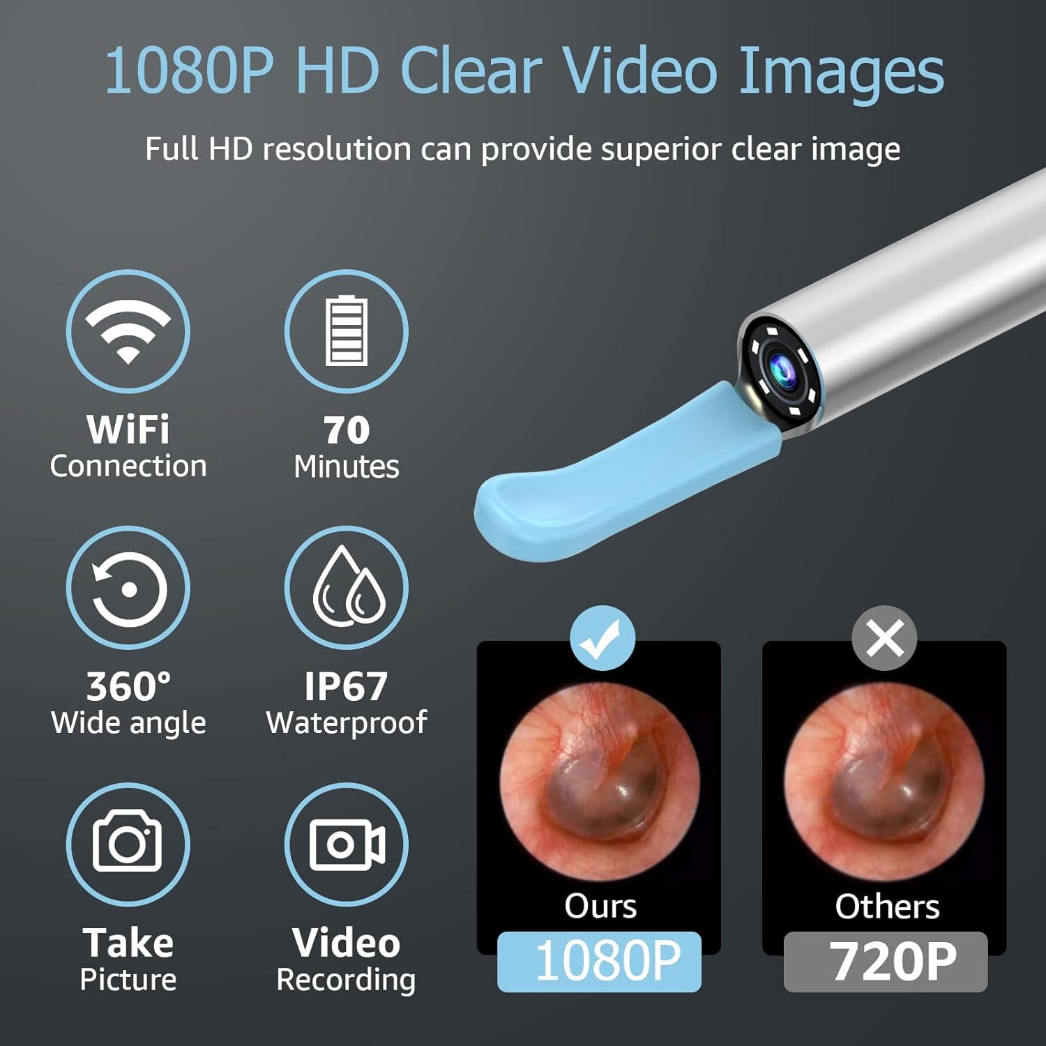 1080P Wireless Otoscope for Ear Wax Removal - WiFi Ear Cleaner Camera ...