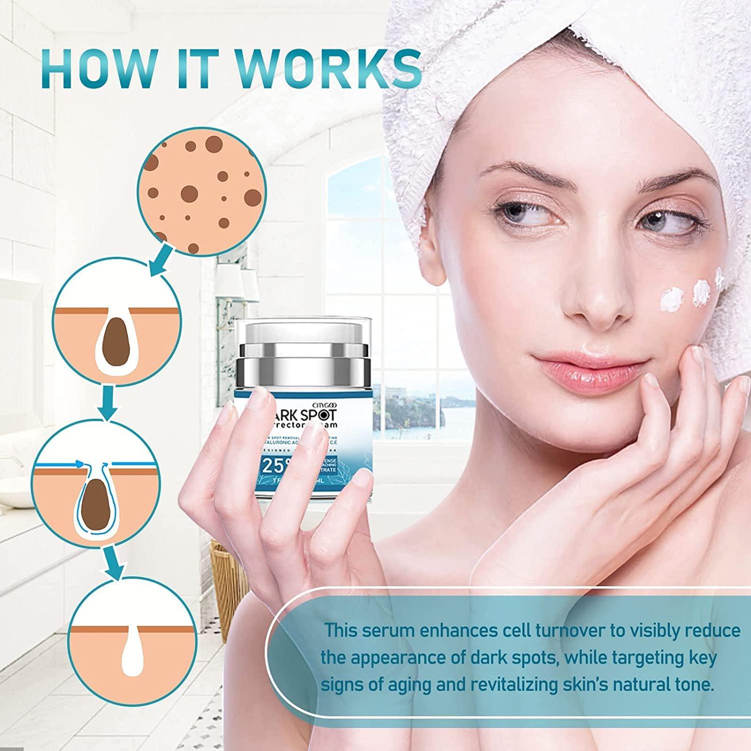 CITYGOO Dark Spot Remover for Face and Body Dark Spot Corrector Cream Melasma Treatment for Face ...