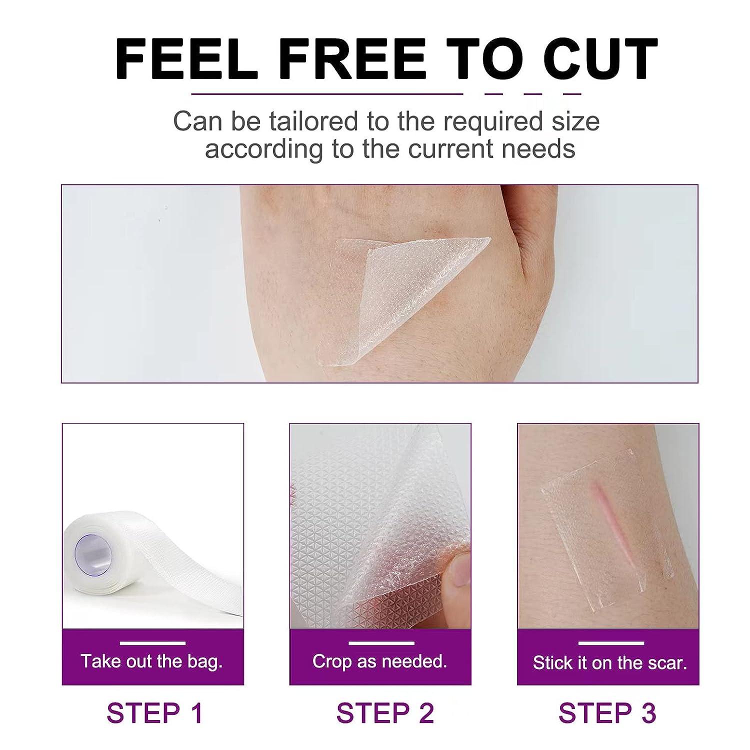 Silicone Scar Sheets | Clear Gel Tape for Surgical Scars, C-Section ...