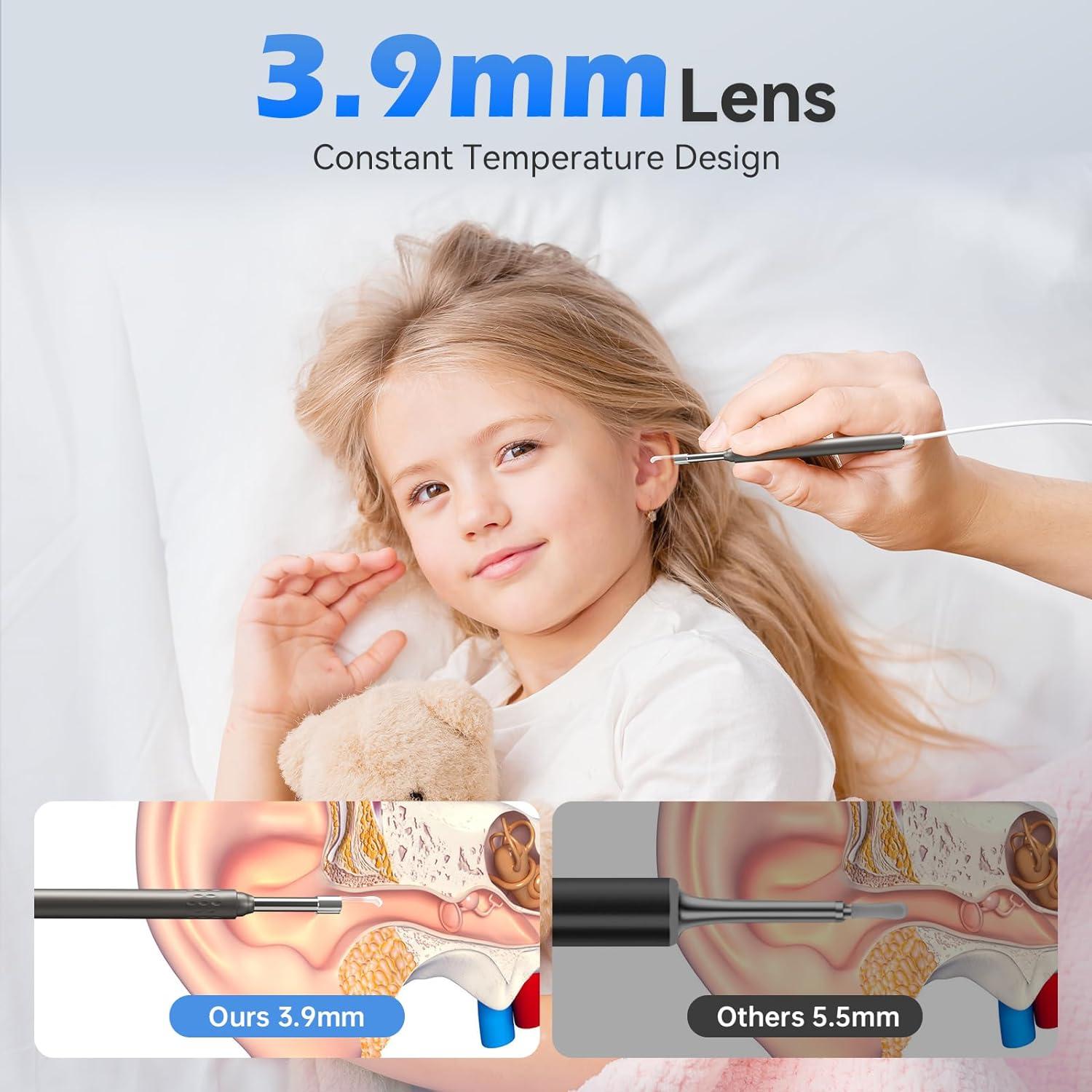 Qimic 10MP Otoscope Ear Camera Kit | Waterproof Ear Wax Remover with 5 ...