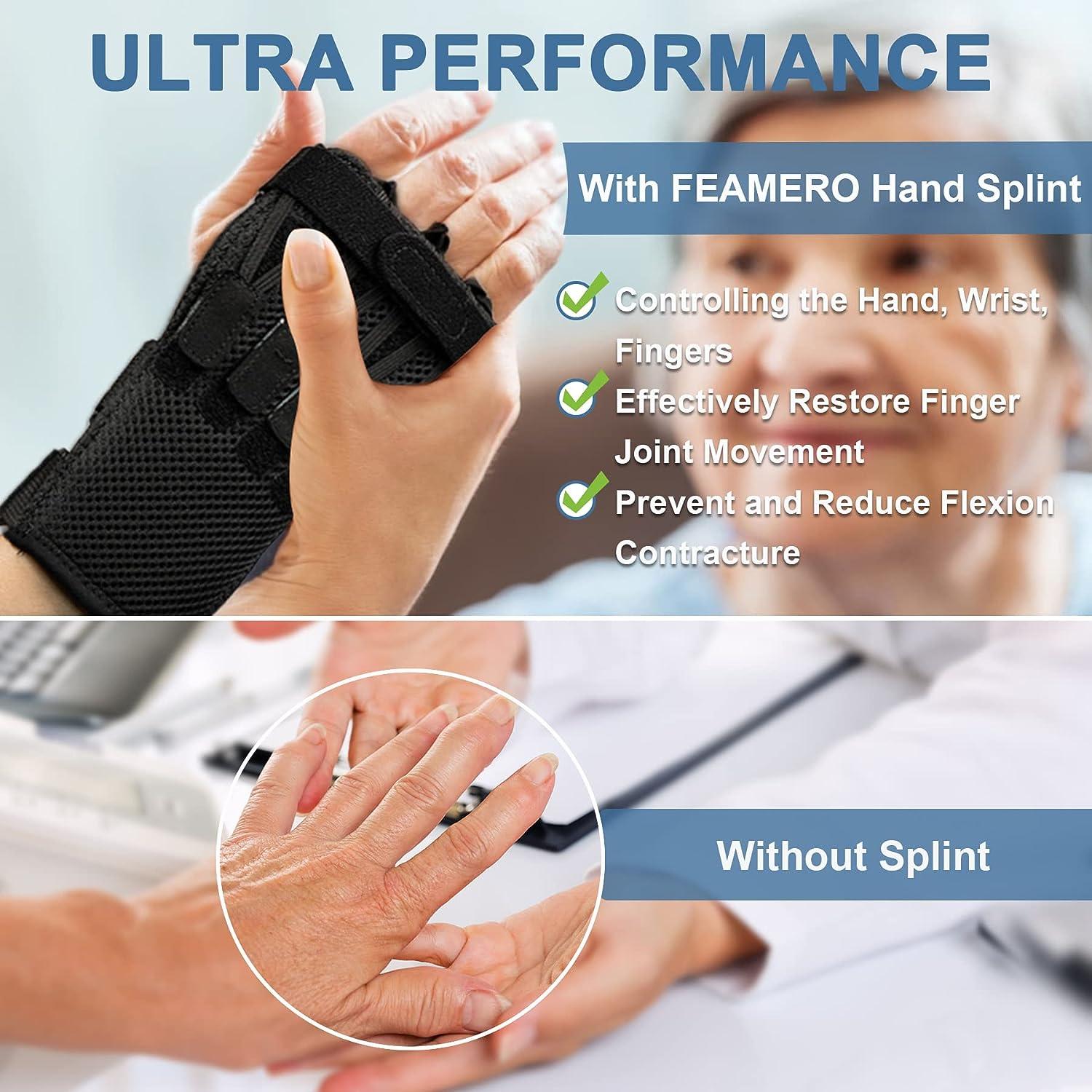 Feamero Radial Nerve Palsy Splint - Adjustable Finger Lift Arm Brace ...