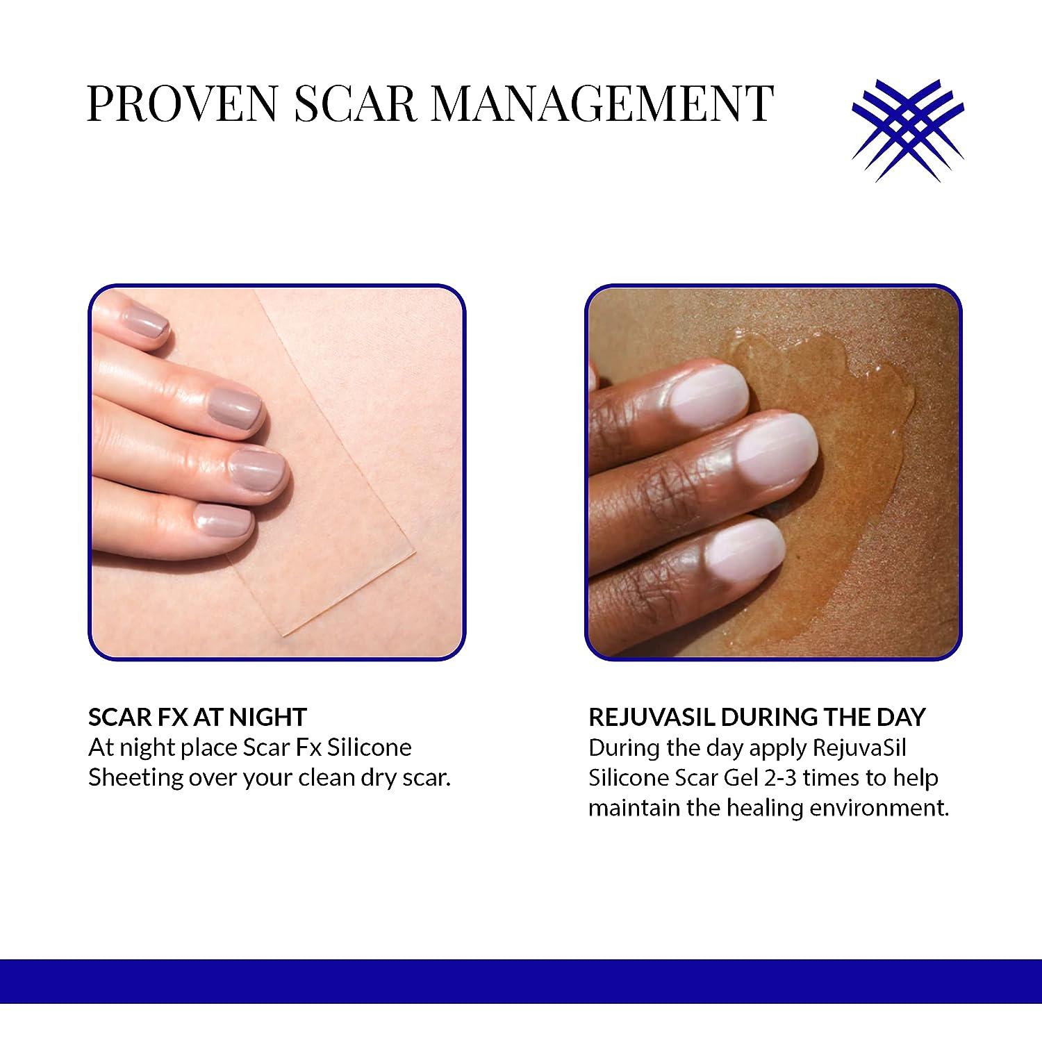 Rejuvaskin Scar Heal Kit - Scar Treatment for Small Scars - Physician ...