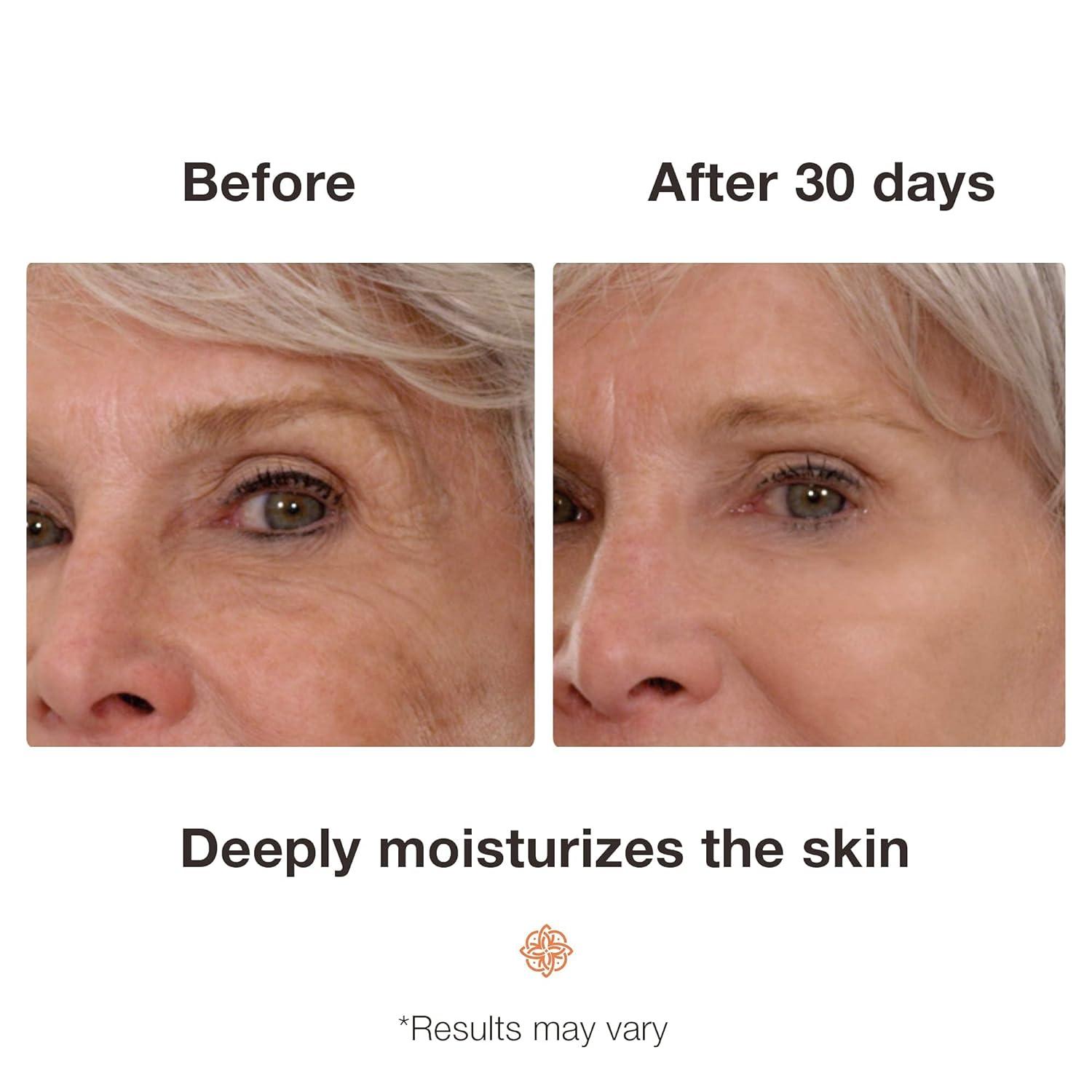 VITASEI Ellixxis Instant Eye & Neck Lifting Gel Bundle - Advanced ...