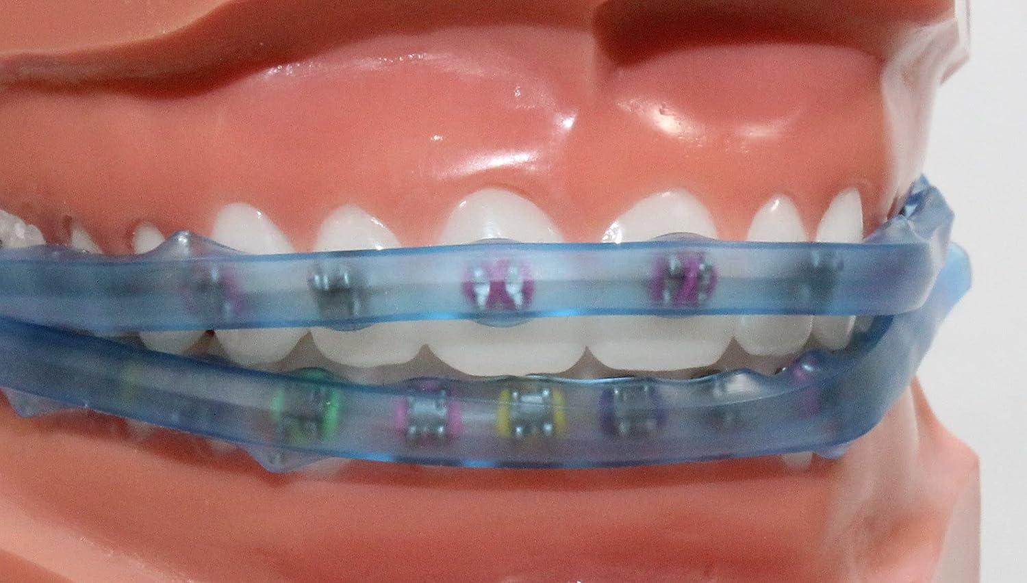 Element Comfort Cover Braces Guard - Snap On Mouth Protector for Braces ...