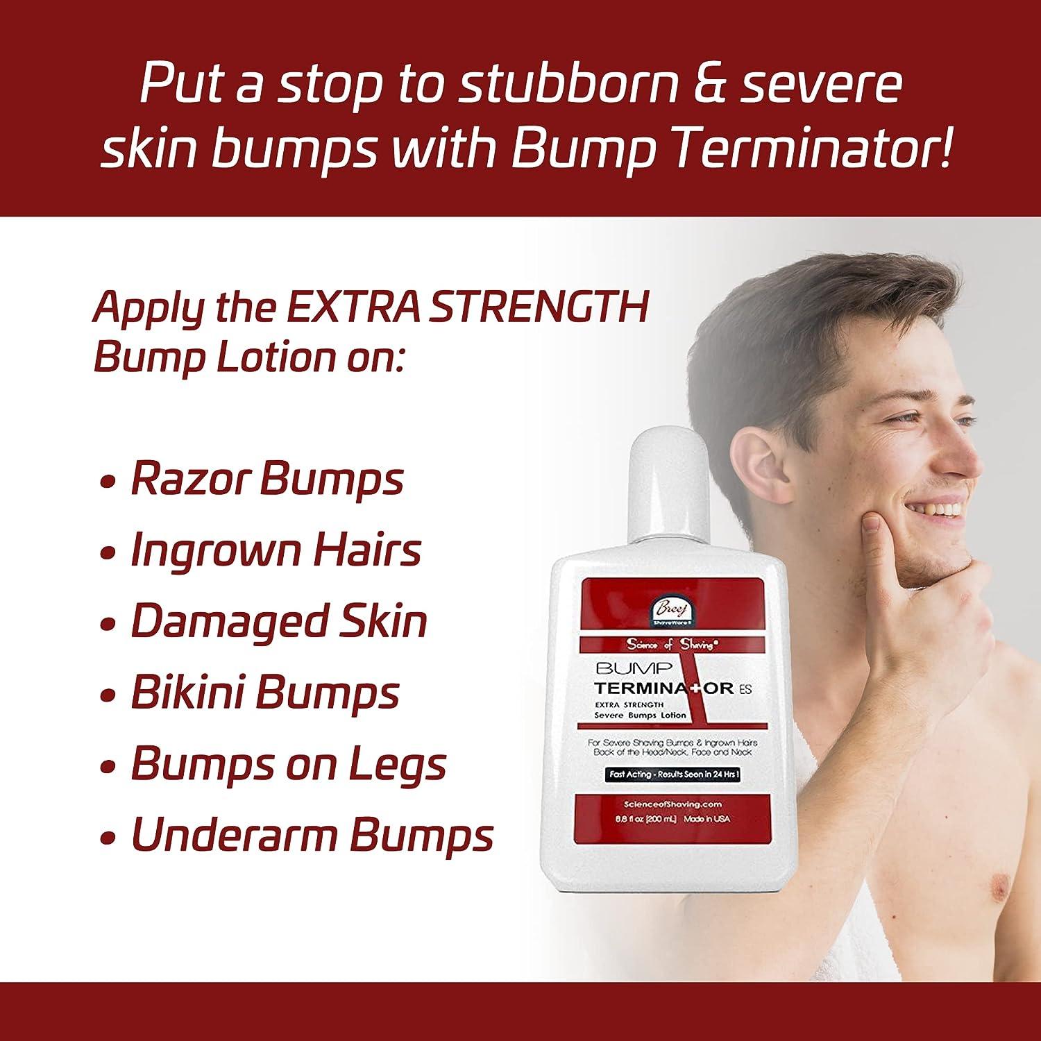 BUMP TERMINATOR Extra Strength Severe Bumps Lotion 6.8 fl oz by Breej ...