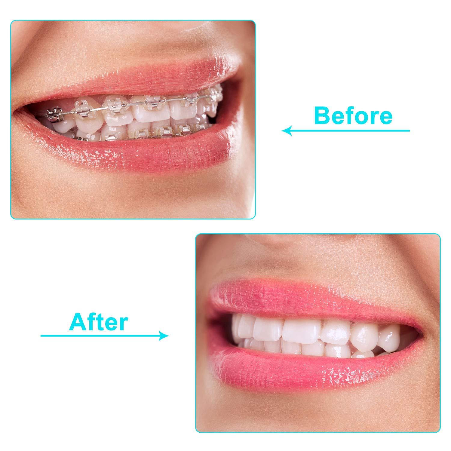 10 White Aligner Chewies Trays - Original Scent Dental Chewies | Buy ...