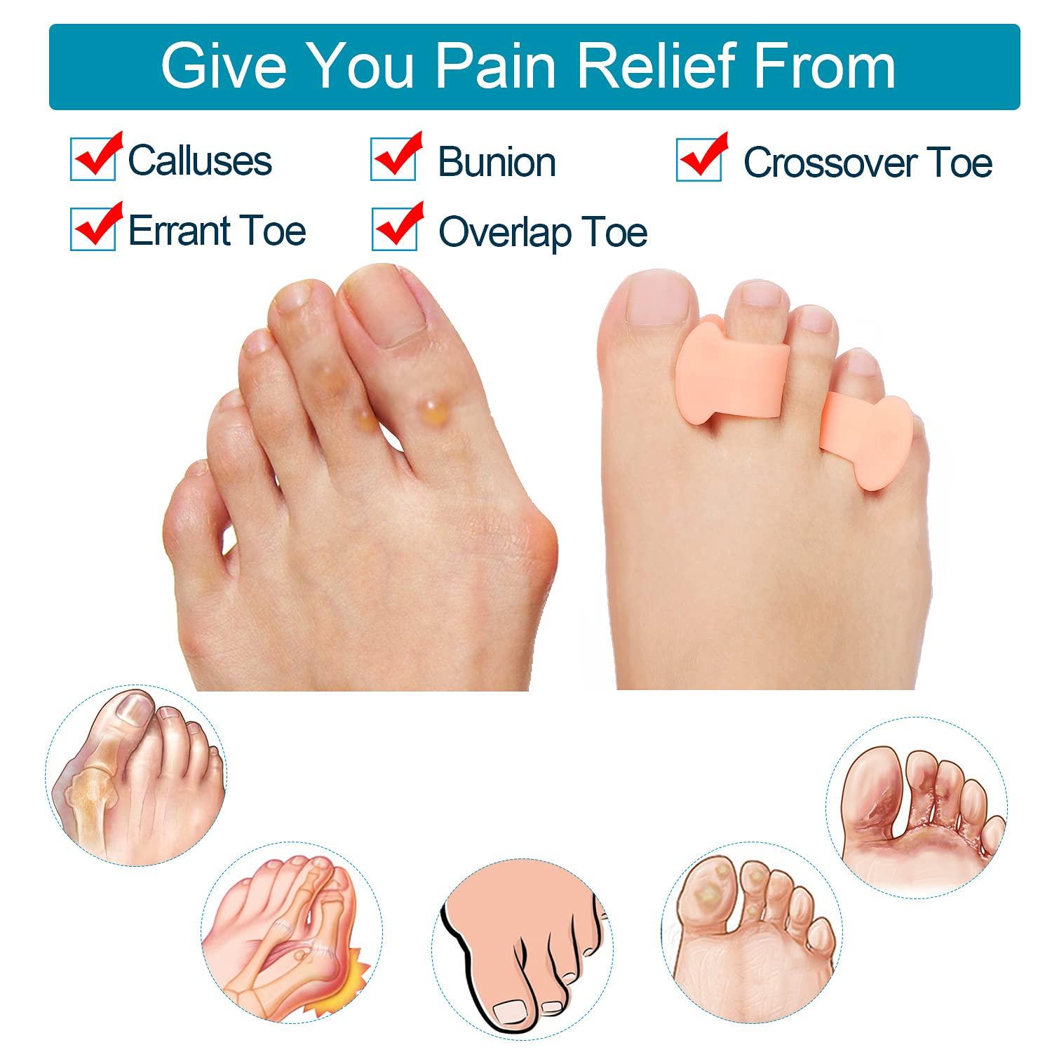 Sumiwish 14 Pack Big Toe Separator & Pinky Toe Spacer - Bunion ...