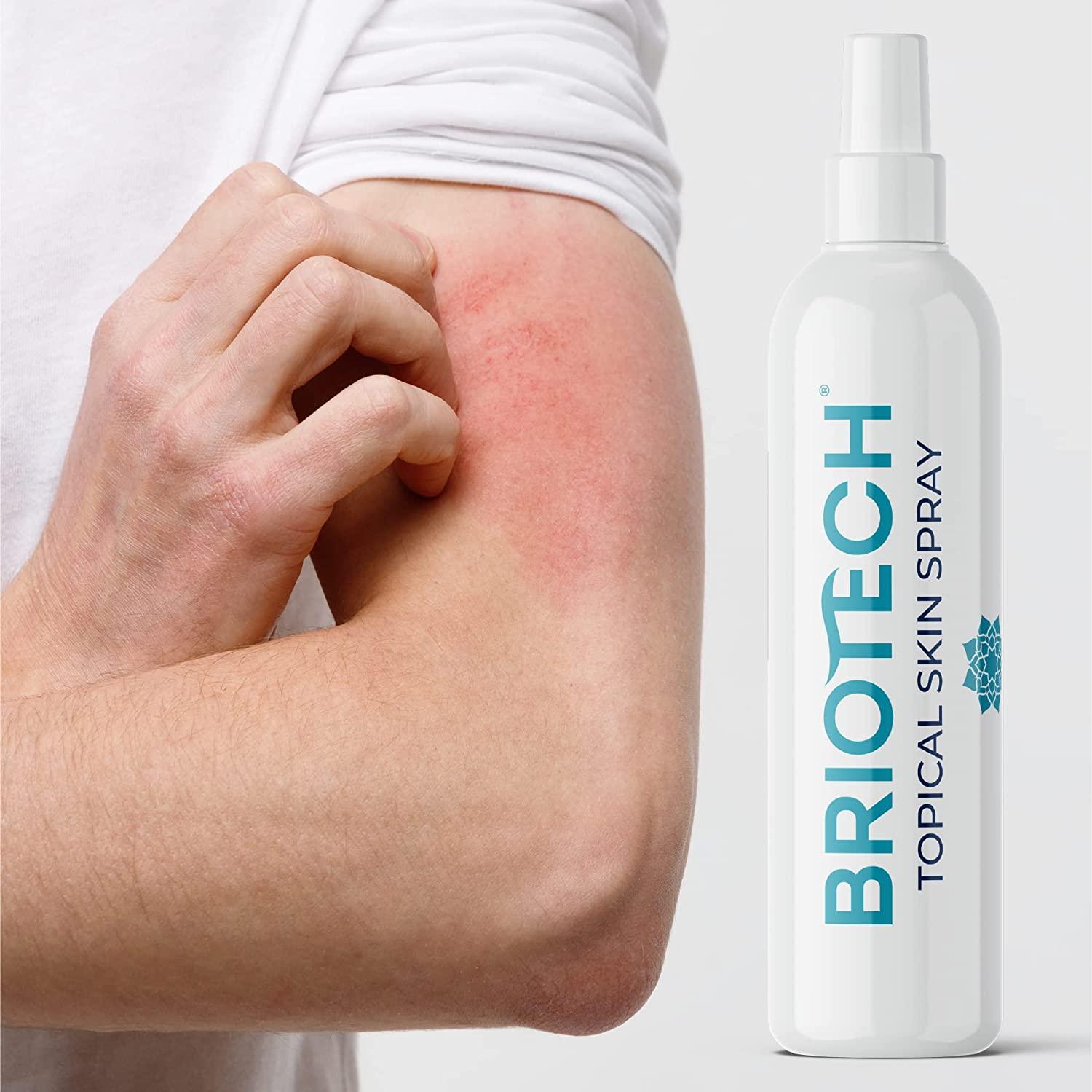 BRIOTECH Topical Skin Spray - Soothing HOCl Pure Hypochlorous for Face ...