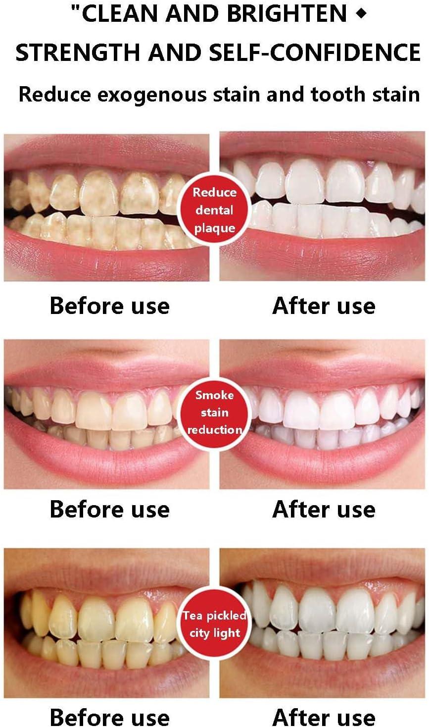 SP-6 Ultra Whitening Probiotic Toothpaste | Brightening Formula | 2 ...