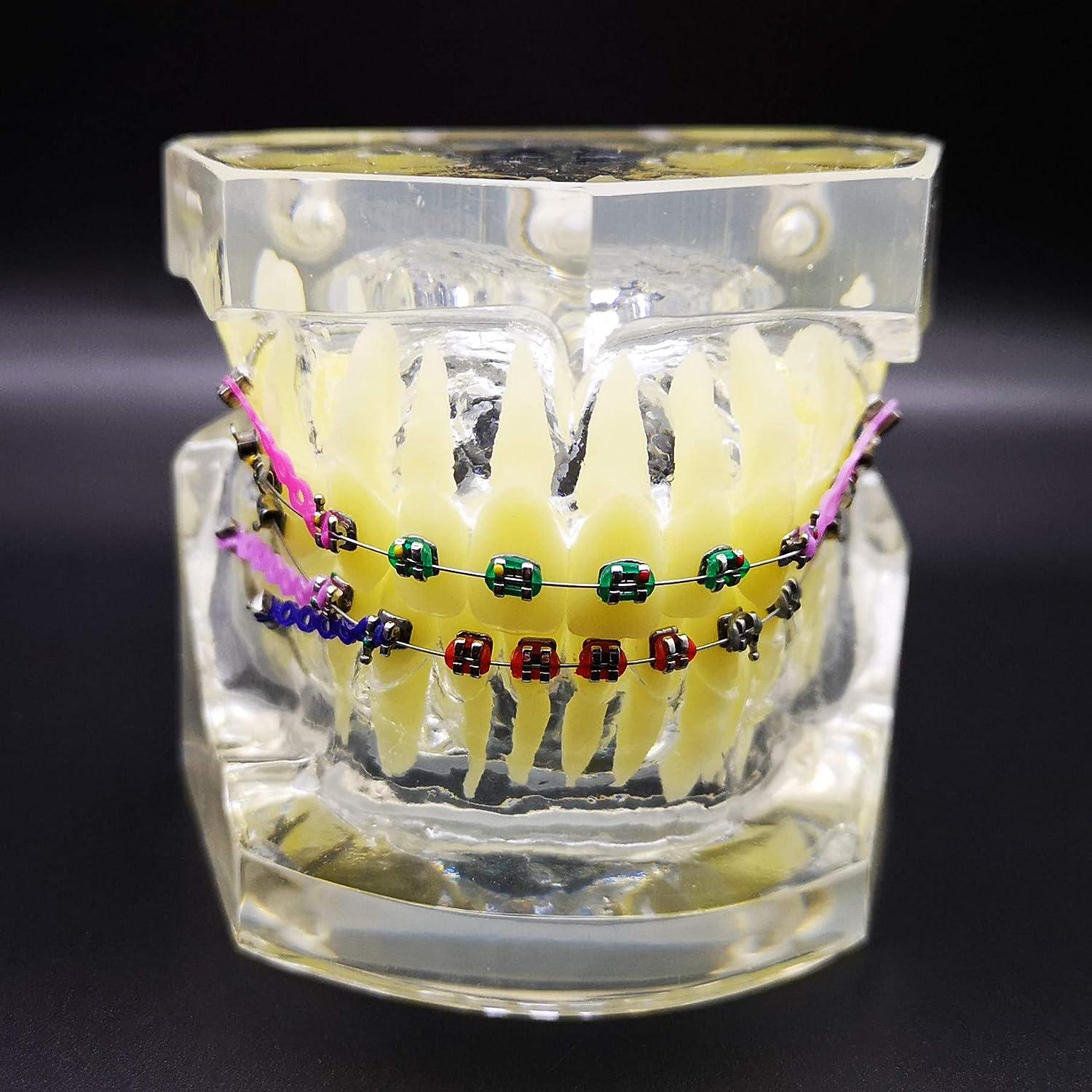 Dental Typodont Orthodontic Teeth Model with Metal Braces & Ligature ...