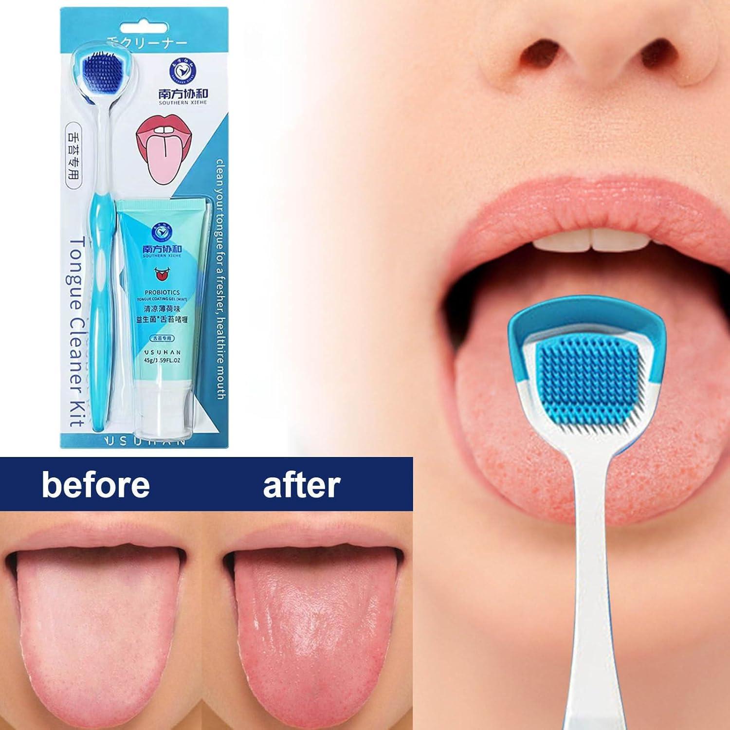 Probiotic Tongue Cleaner Set - Oral Hygiene Brush & Tongue Cleansing ...