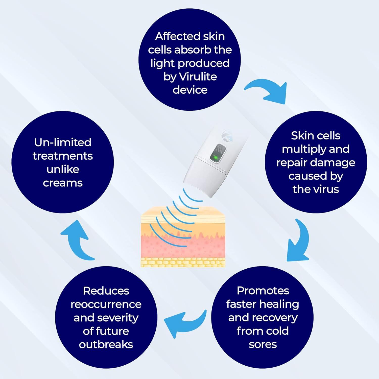 Virulite CS 2.0: FDA Cleared Invisible Light Cold Sore Treatment | Buy ...