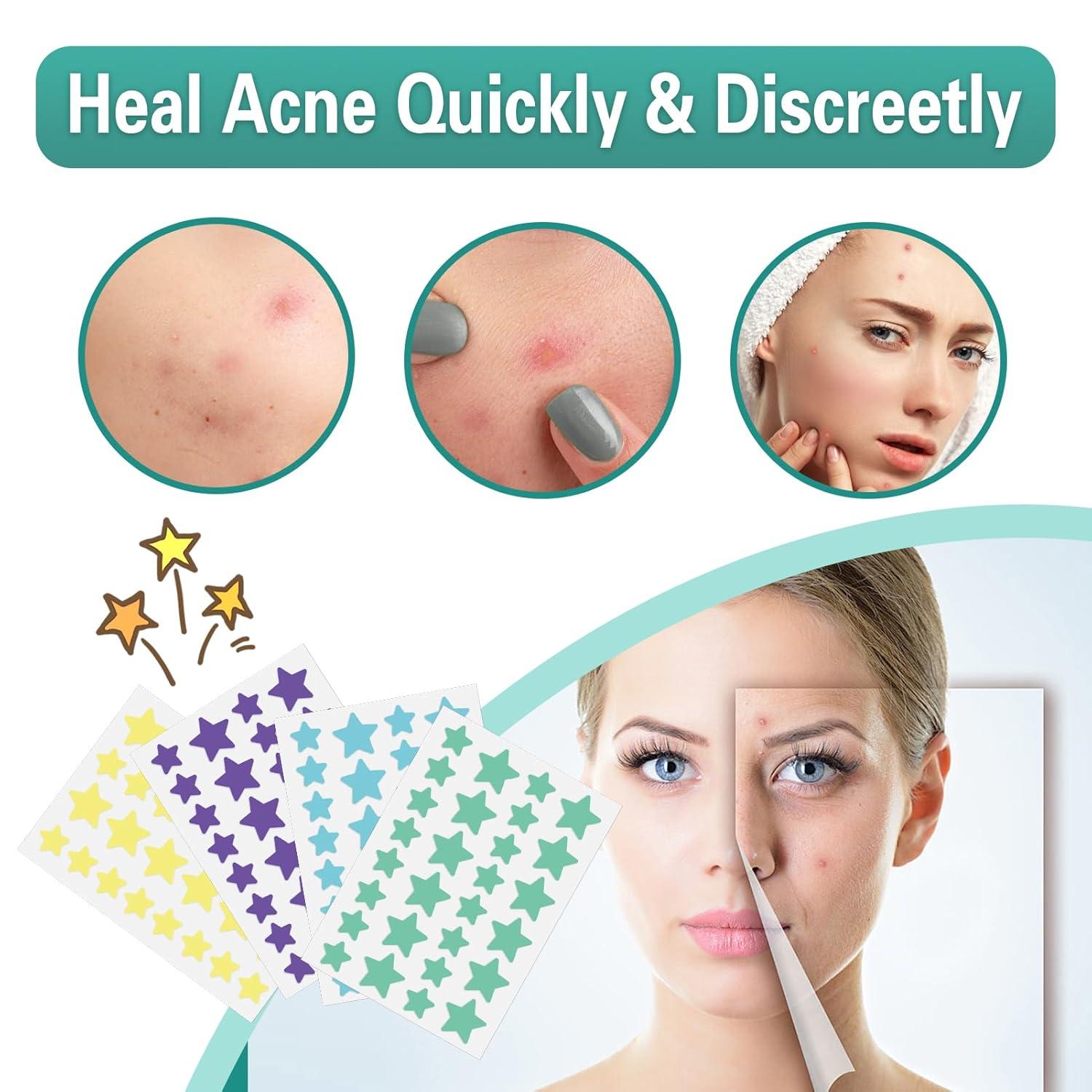 112 Counts Star-Shaped Pimple Patches - Hydrocolloid Acne Stickers for ...