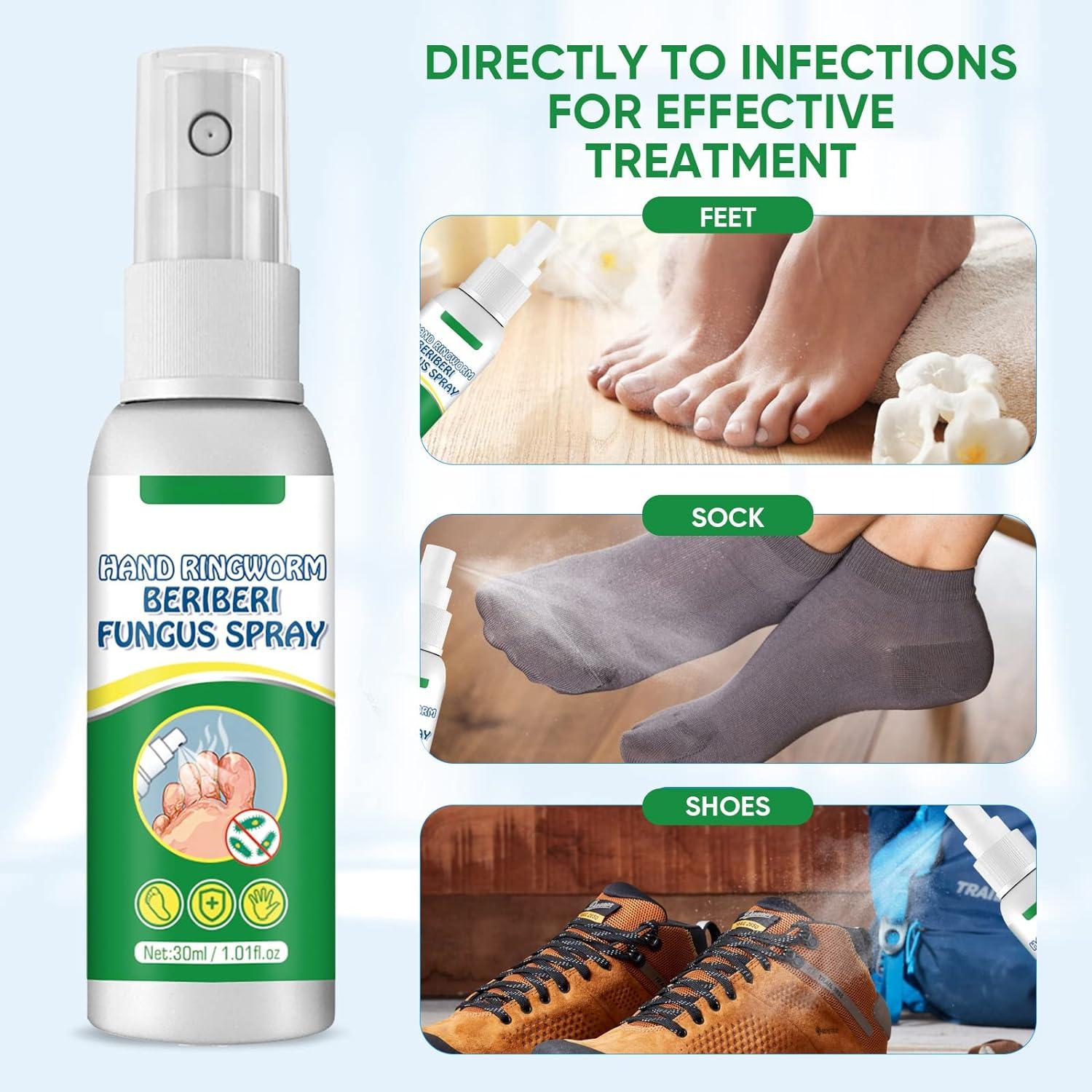 Natural Anti-Fungal Foot Spray for Athlete's Foot Treatment - Relieves ...