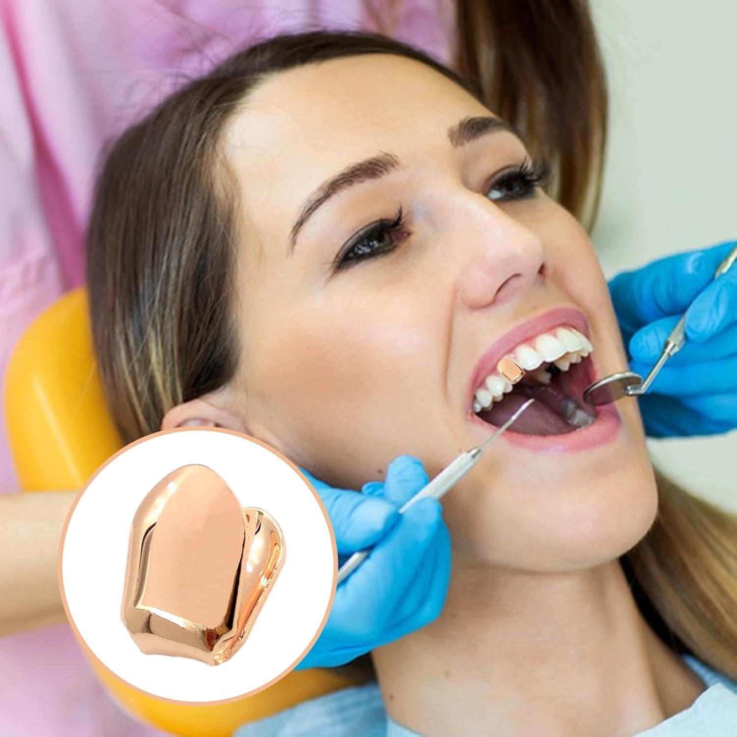 Single Gold Tooth Cap - 14k Gold Realistic Fake Teeth Grills Gold Plated Realistic Fake Teeth ...