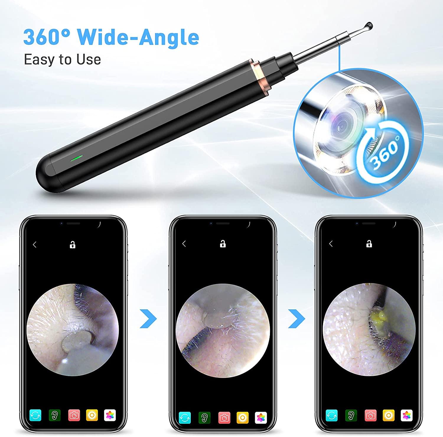AWELOR Ear Wax Removal Camera - 1296P HD Endoscope Ear Cleaner for ...