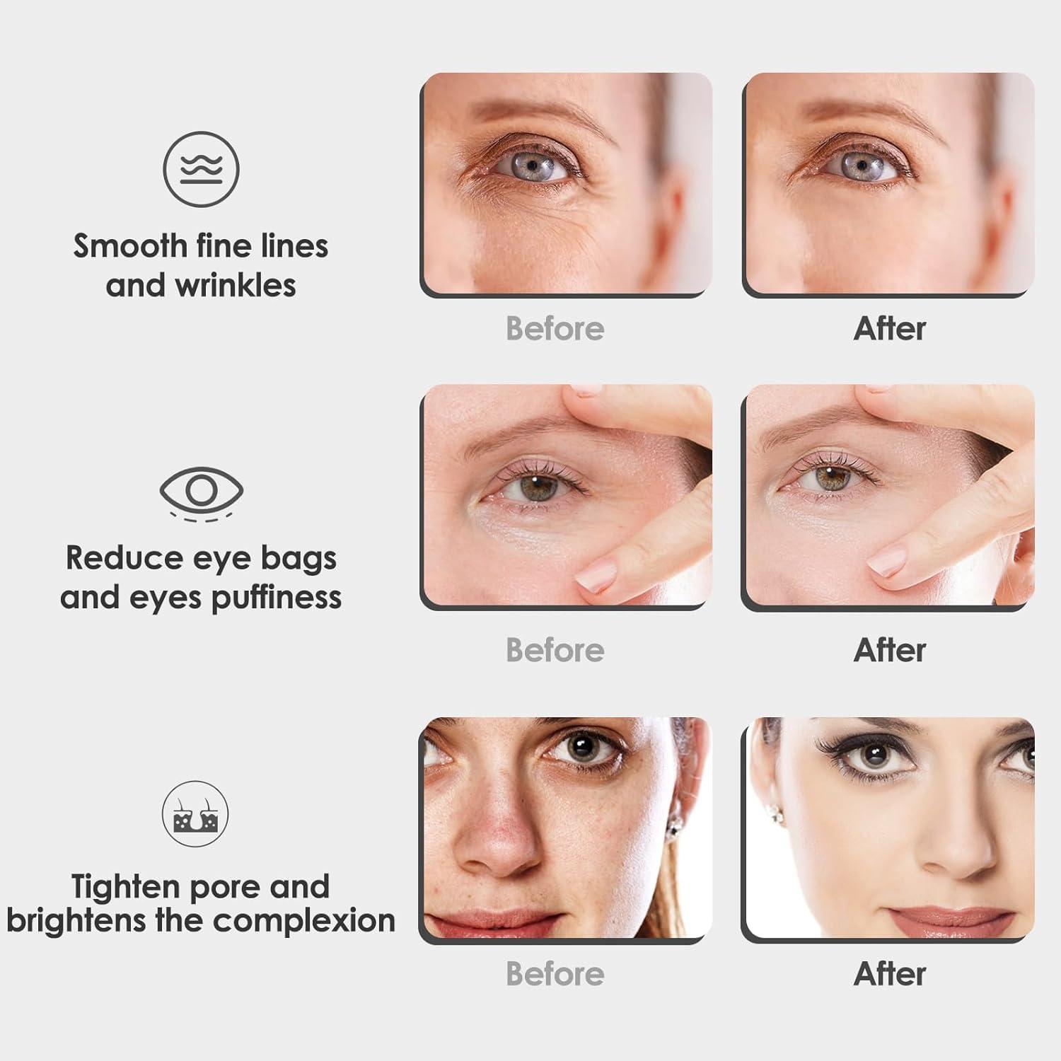 Rotating Stainless Steel Ice Balls for Facials | Unbreakable Skin Care ...