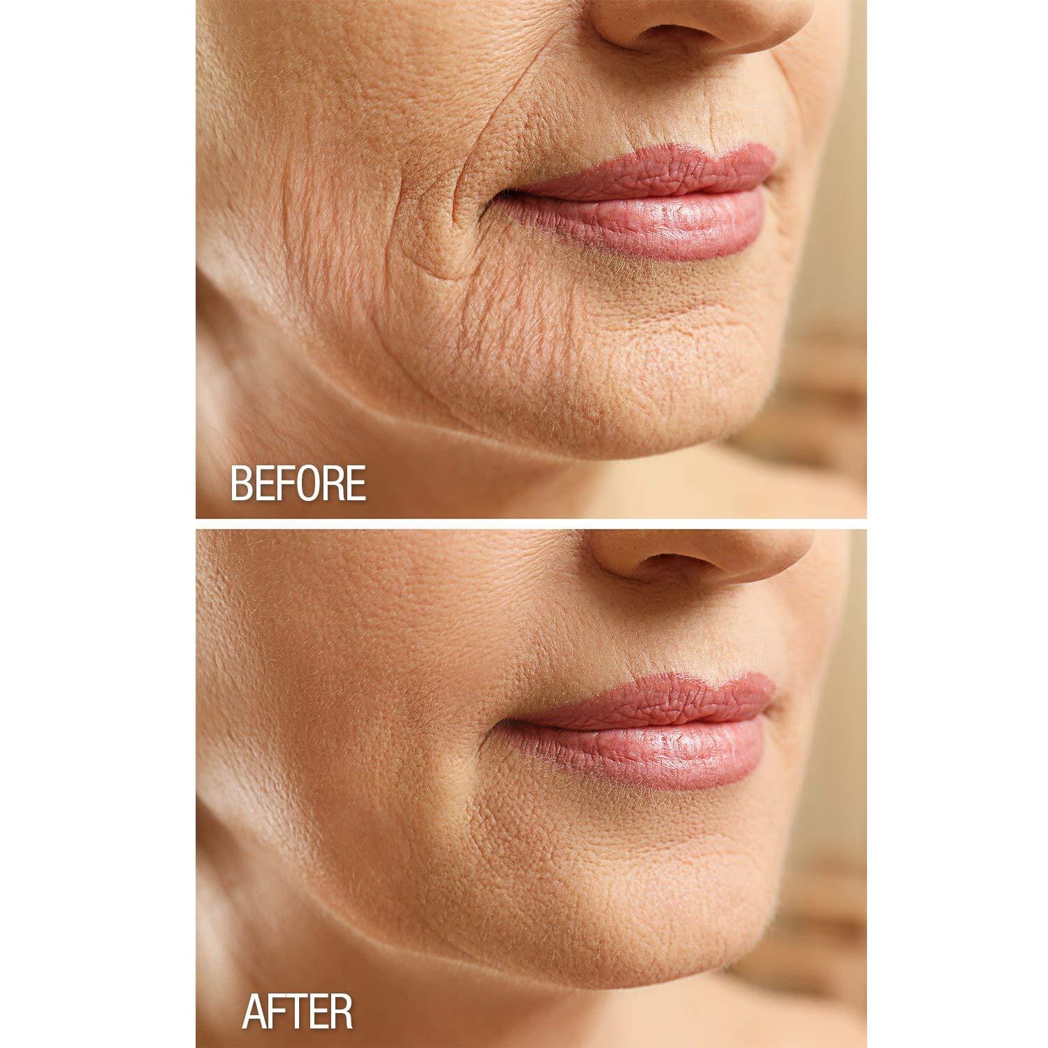 Crepe Be Gone Cream Body Souffle - Smooth, Plump, and Firm Dry, Aging ...