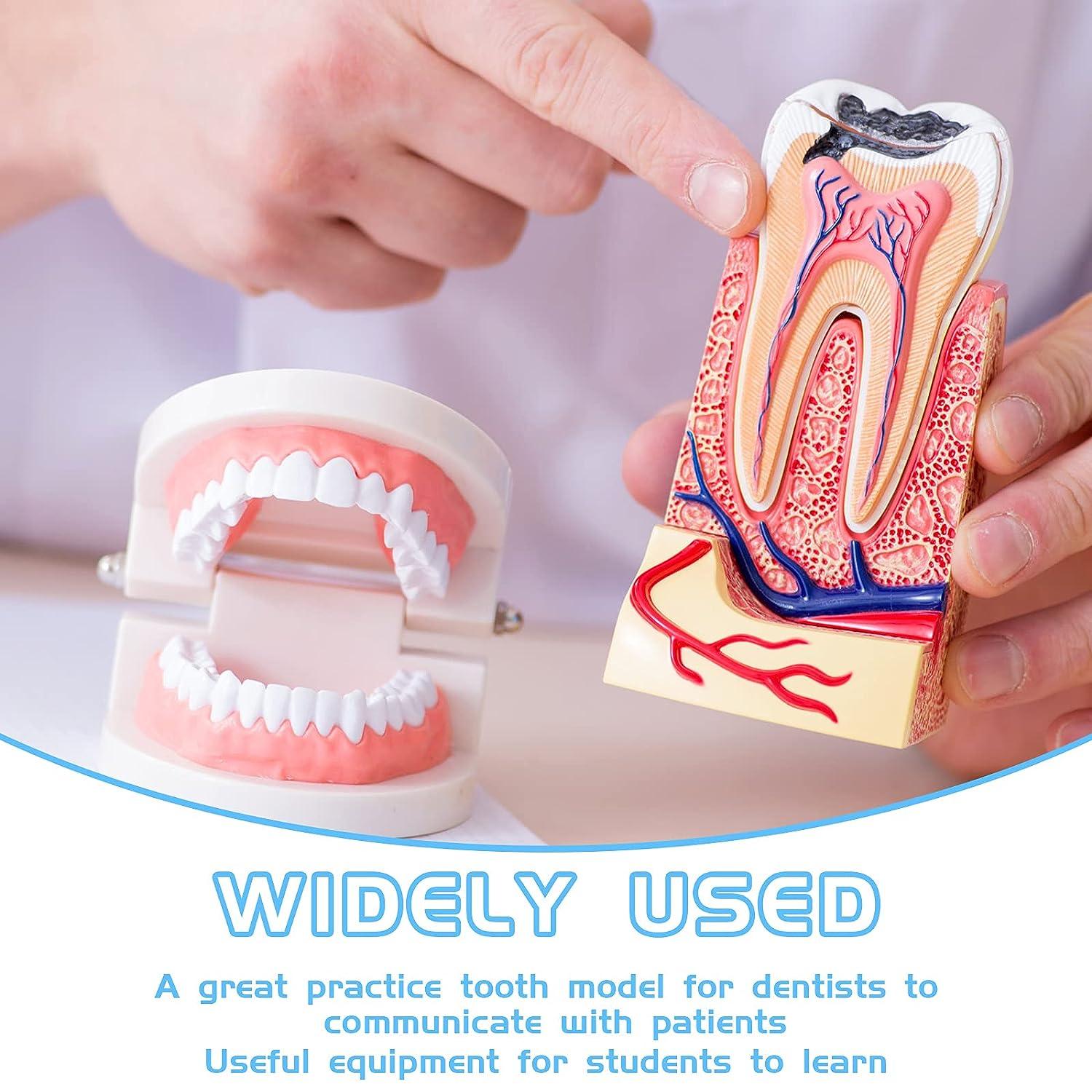 Dental Teeth Model Set - 12 Pcs Plastic Standard Teeth Models for ...