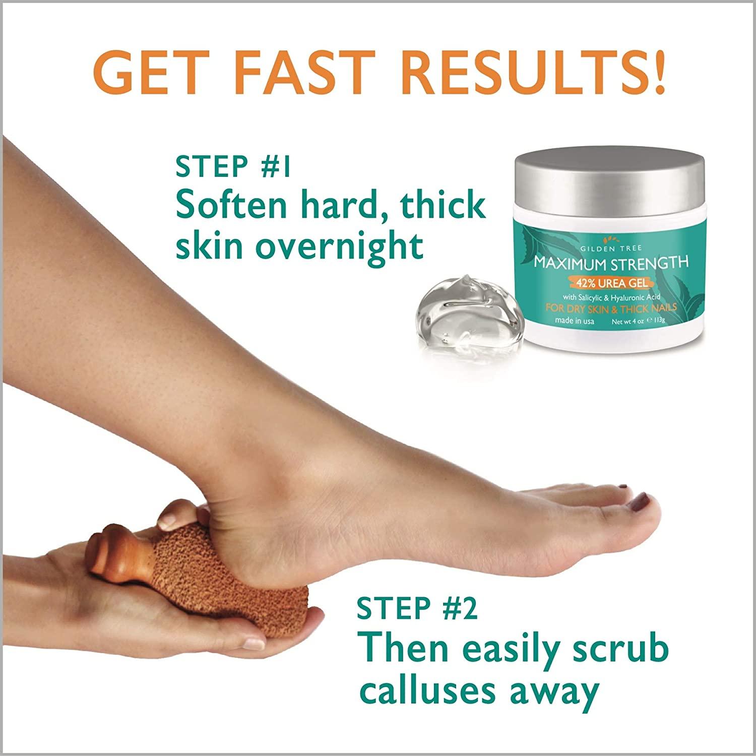 Callus Remover Gel & Foot Scrubber Kit â€“ Ultimate Pedicure Tools for ...