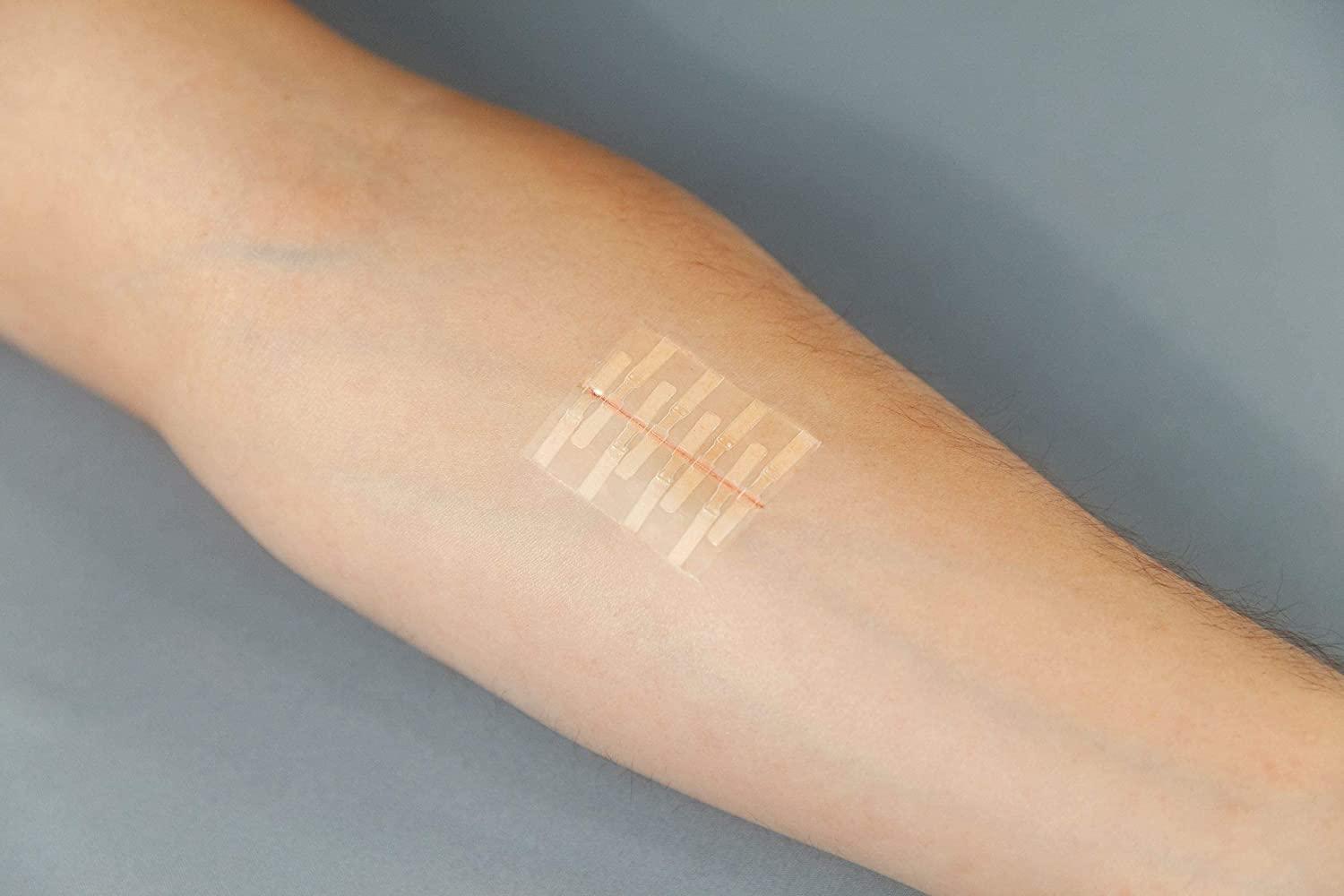 Clozex Emergency Laceration Kit - FDA Cleared Skin Closure Device for ...