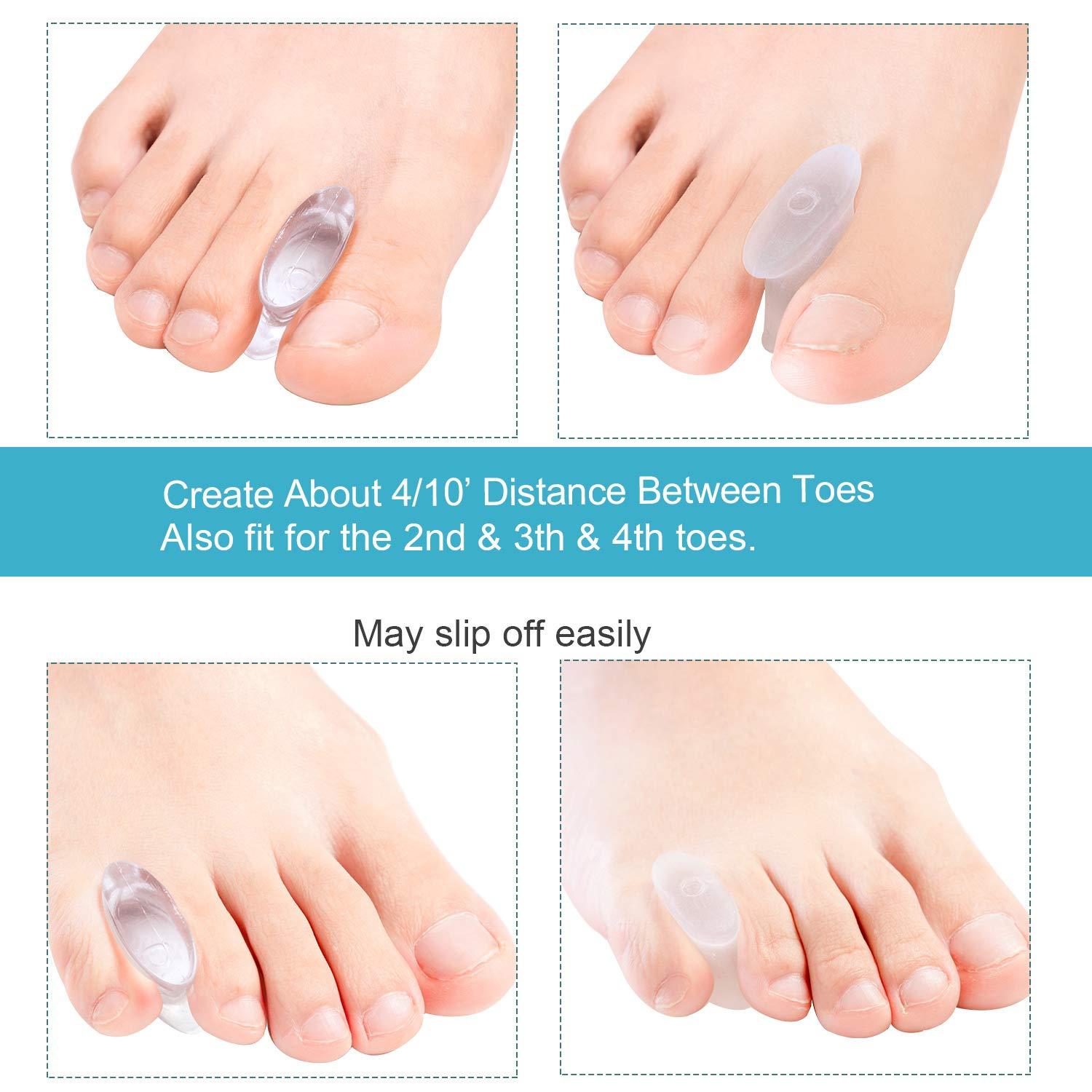Povihome Gel Bunion Corrector and Toe Separators - Small Size, 10 Pack ...
