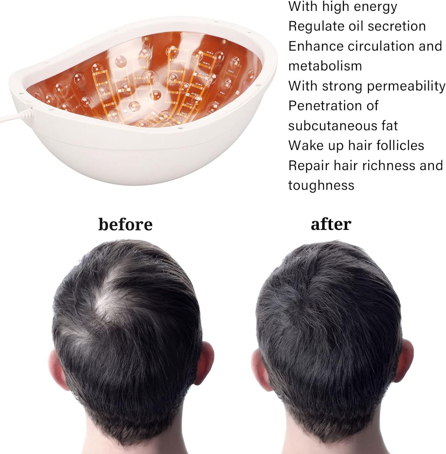 LED Hair Growth Helmet for Men and Women - Hair Regrowth Treatment ...