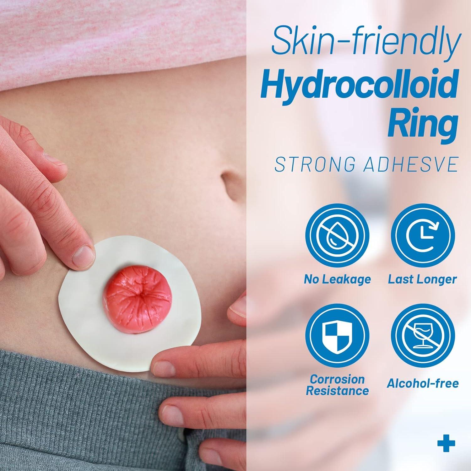 Heagimed 4mm Moldable Ostomy Rings - 10pcs Hydrocolloid Stoma Barrier ...